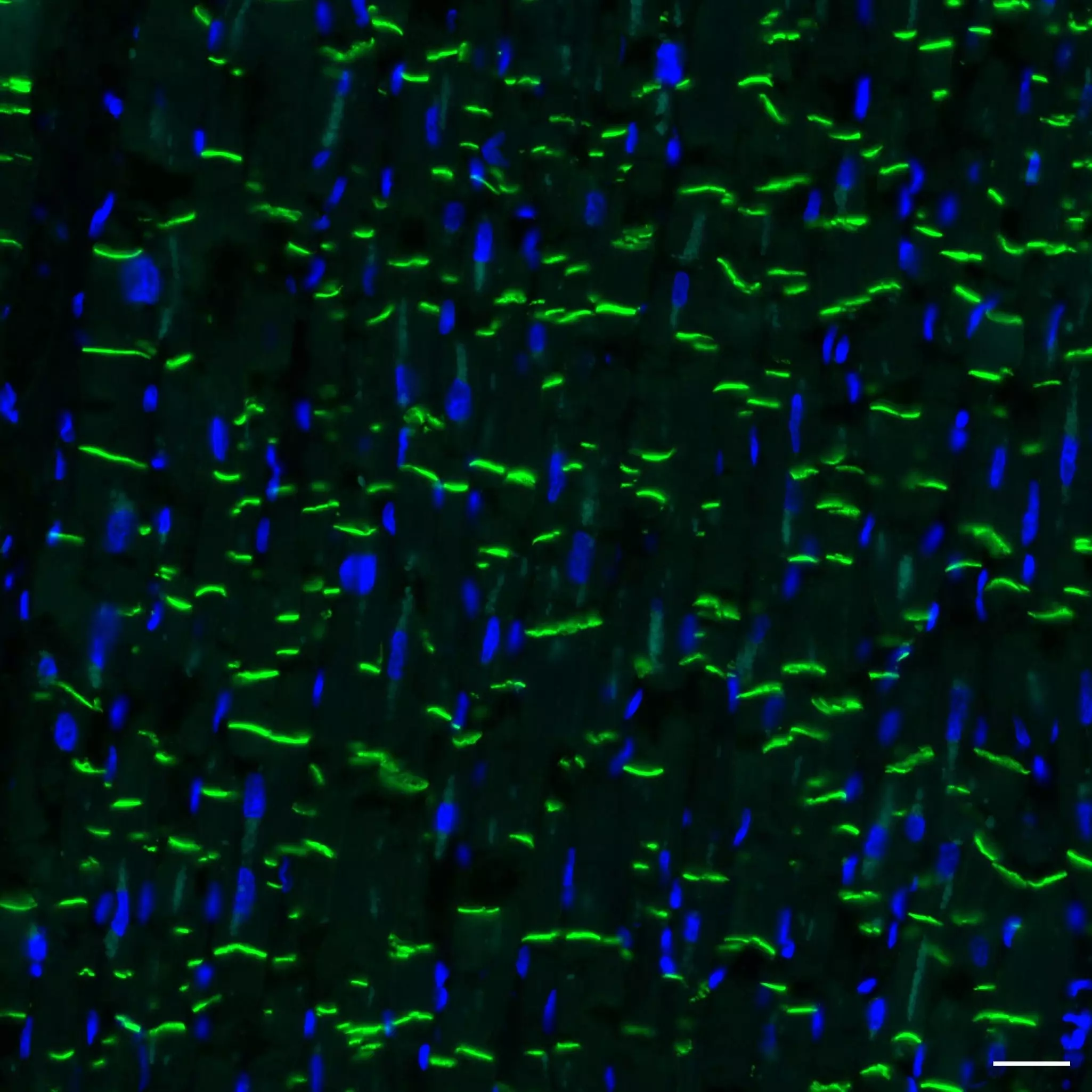 CD325 (N-Cadherin) Antibody, anti-human, REAdye_lease™ | Miltenyi ...