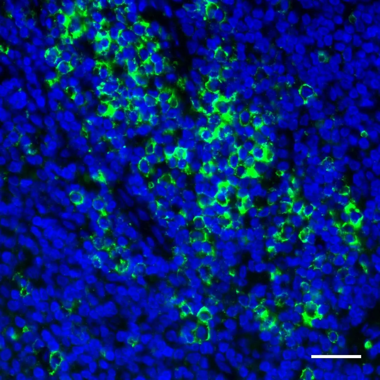 CD38 Antibody, anti-human, REAdye_lease™ | Miltenyi Biotec | USA