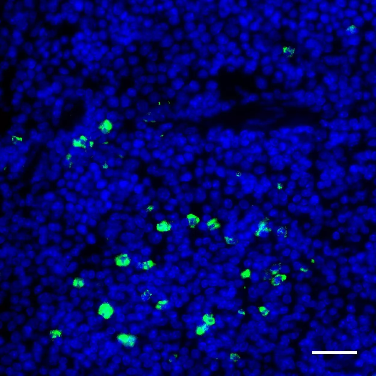 Ly-6G Antibody, anti-mouse, REAlease® | Miltenyi Biotec | India