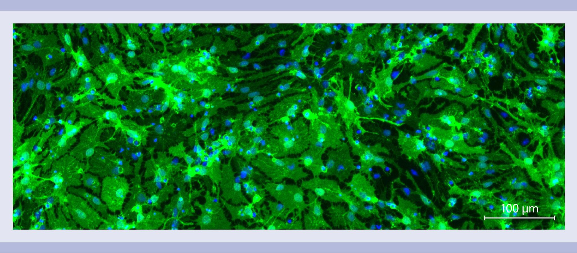 Astrocytes | Astrocyte Culture Isolation Characterization ...