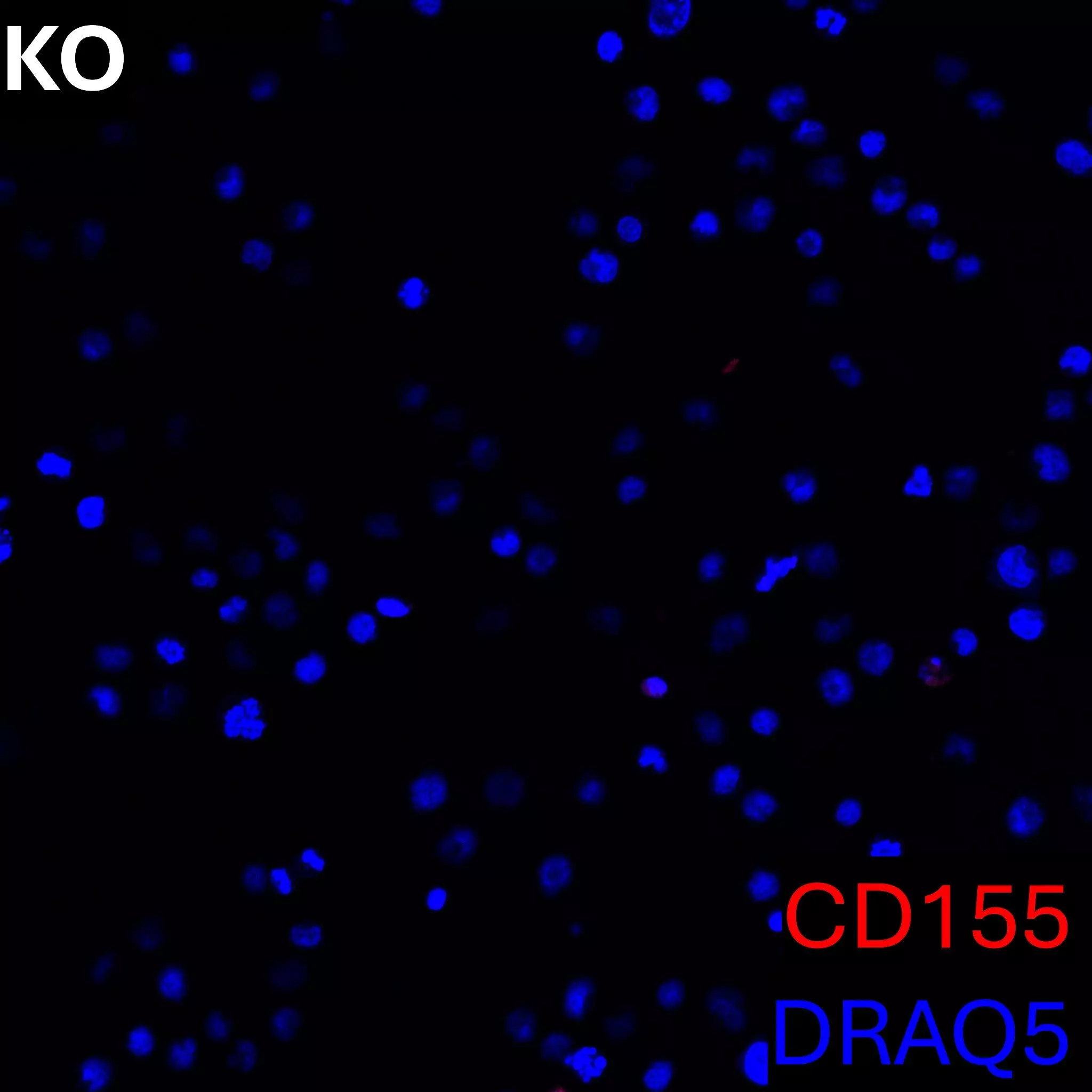 CD155 Antibody, anti-human, REAfinity™ | Miltenyi Biotec | 대한민국