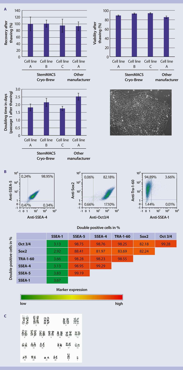 Human IPS cells | Human embryonic stem cells | Miltenyi Biotec ...