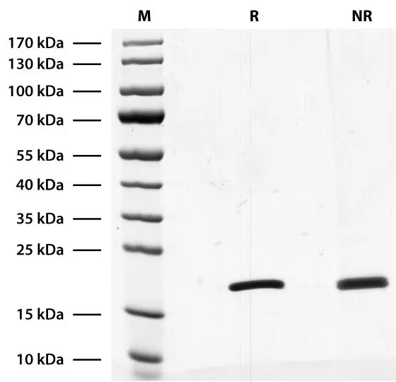 Human IL-37b | Miltenyi Biotec | Deutschland