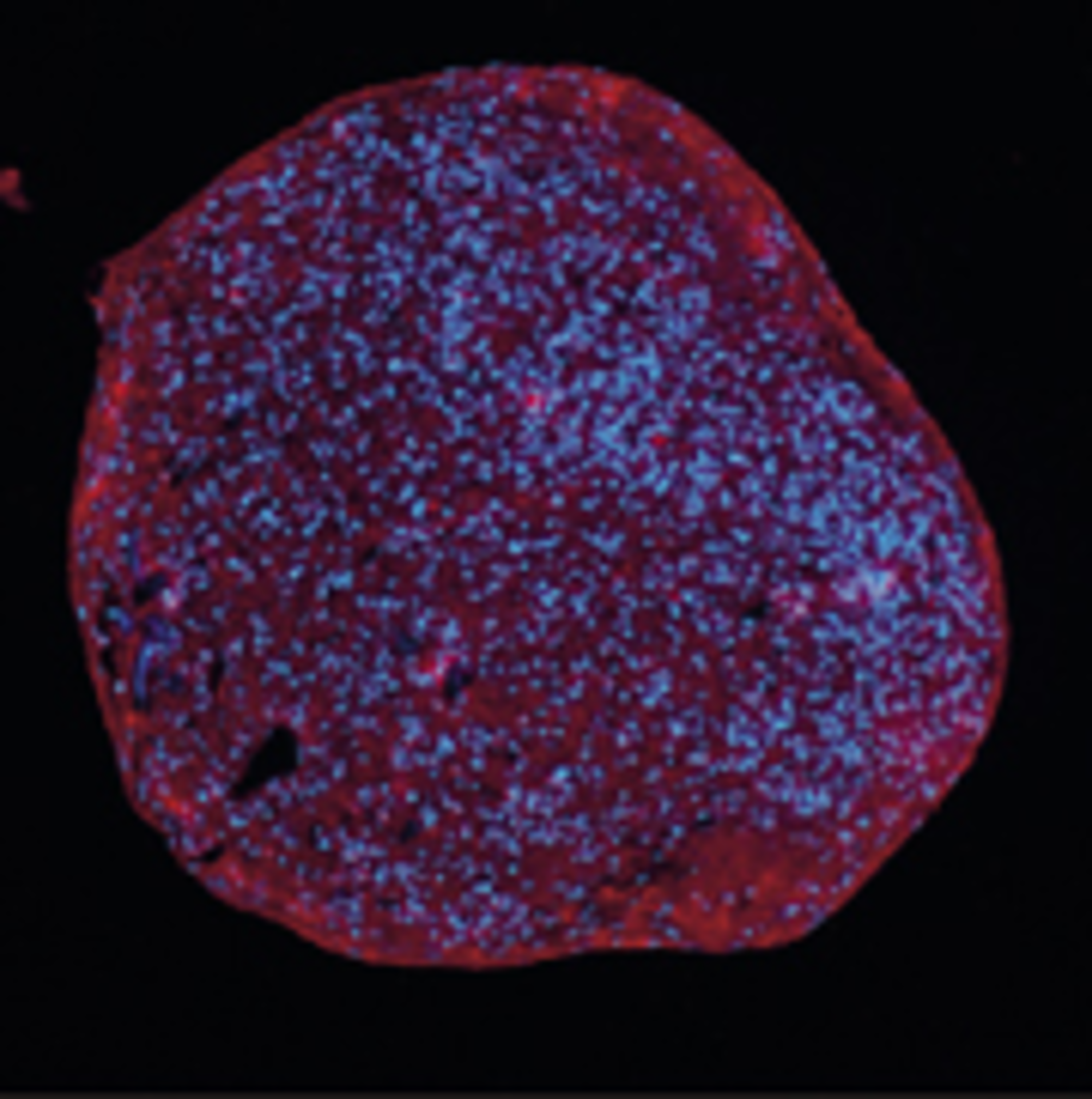 Umbilical cord-derived mesenchymal stem cells (MSCs) | Miltenyi Biotec ...