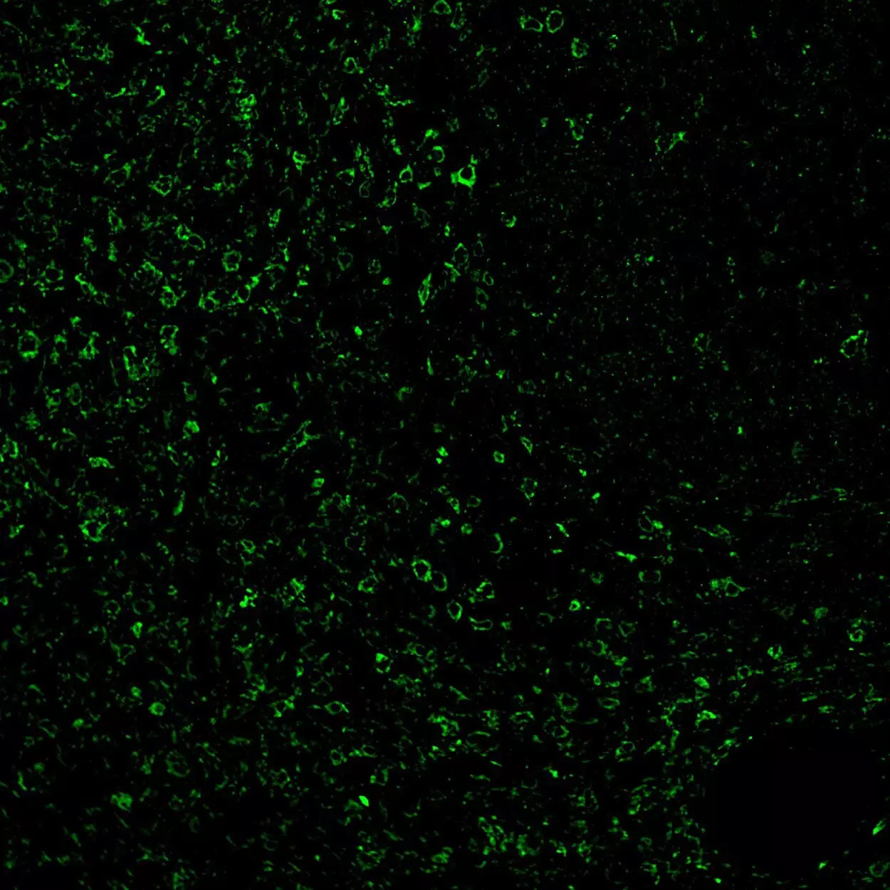 CD195 (CCR5) Antibody, anti-human, REAfinity™ | Miltenyi Biotec | USA