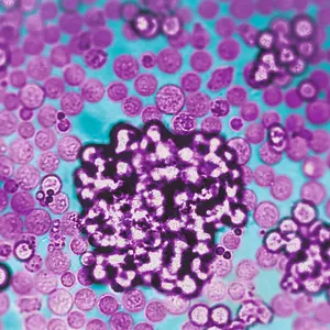 CD4 MicroBeads, human | Miltenyi Biotec | USA