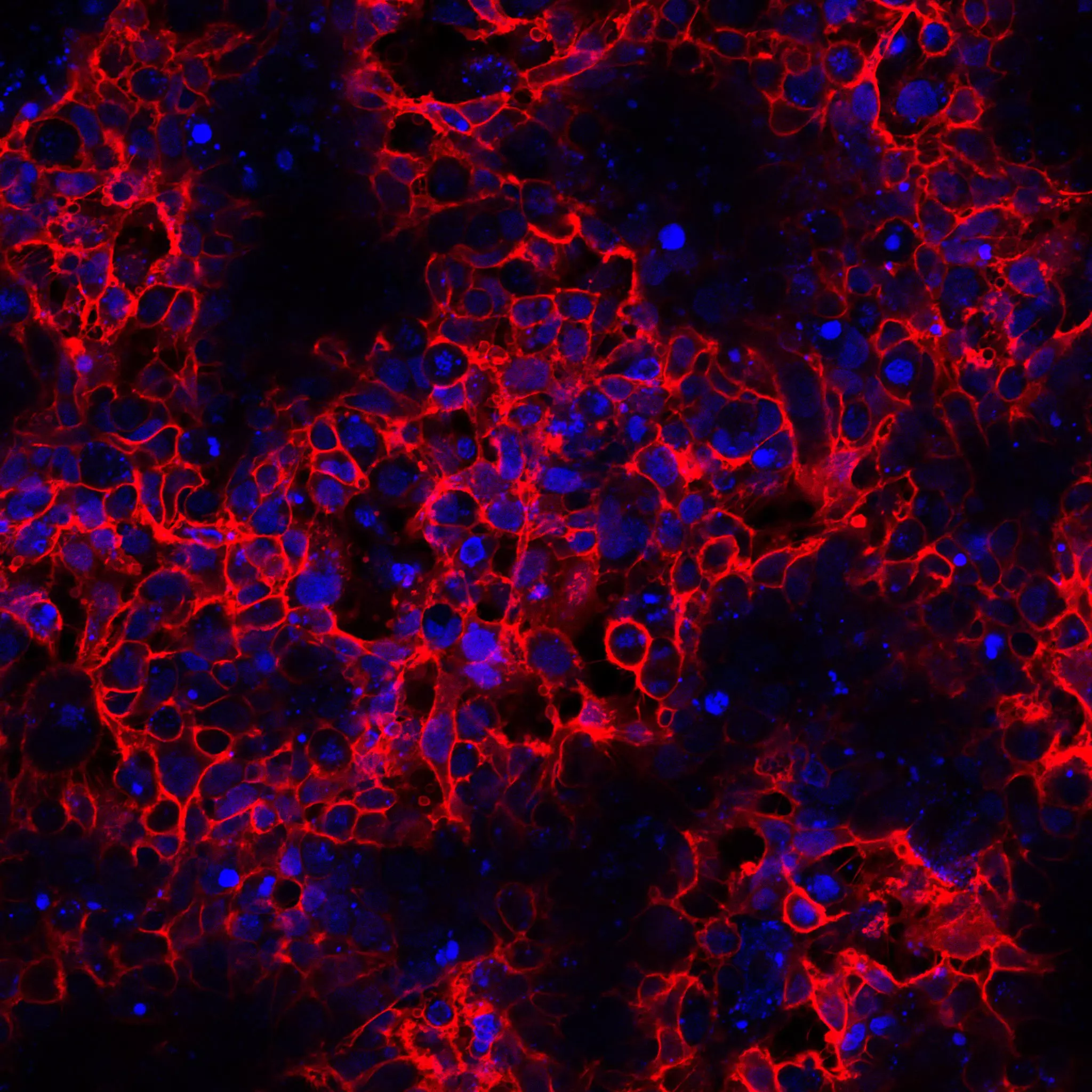 CD326 (EpCAM) Antibody, anti-human, REAfinity™ | Miltenyi Biotec | USA
