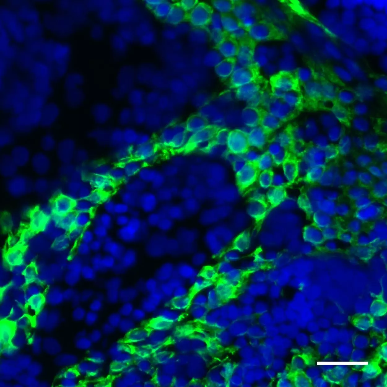 CD366 (TIM-3) Isoform 2 Antibody, anti-human, REAdye_lease™ | Miltenyi ...
