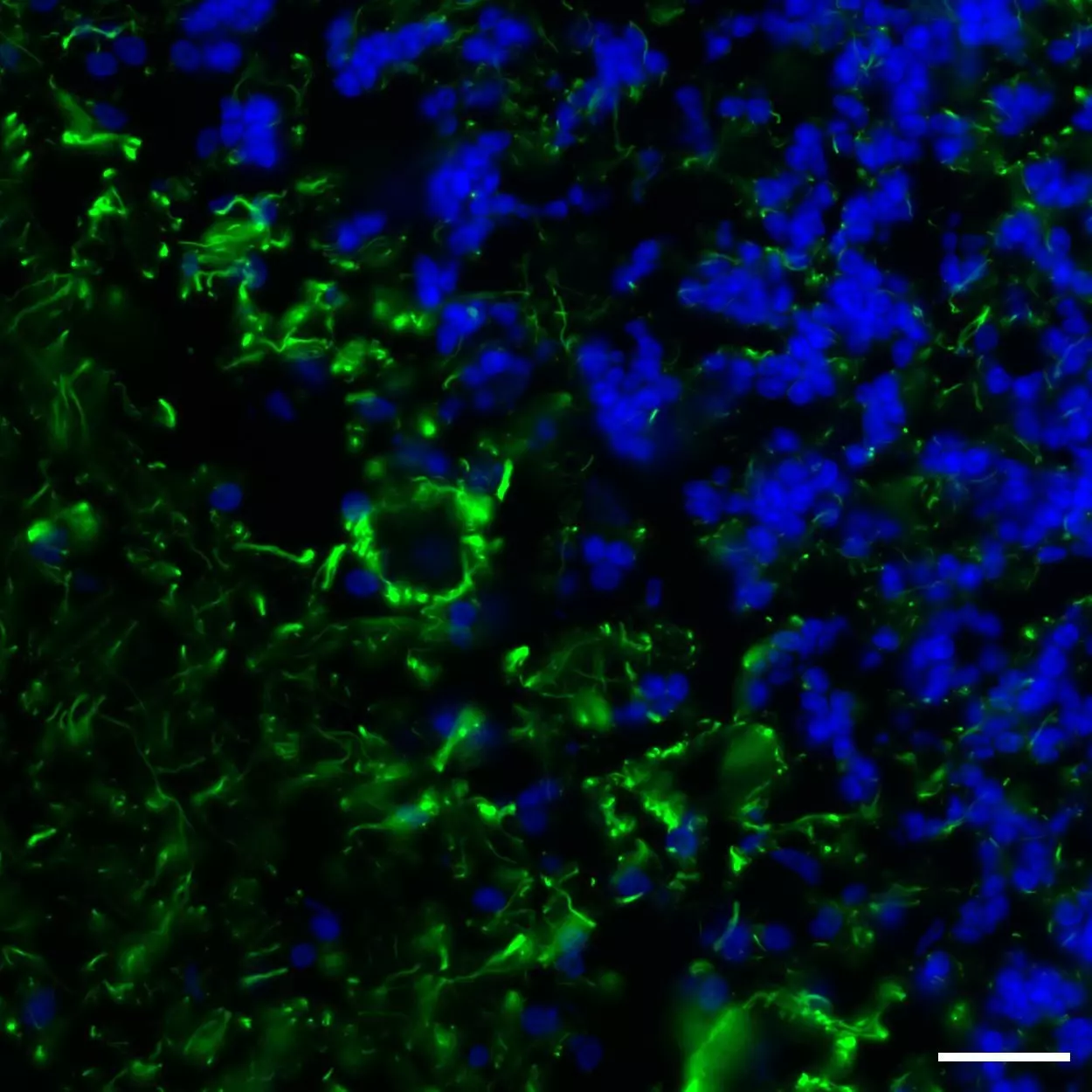 Neurofilament H (200 kD) Antibody, anti-human/mouse, REAdye_lease ...