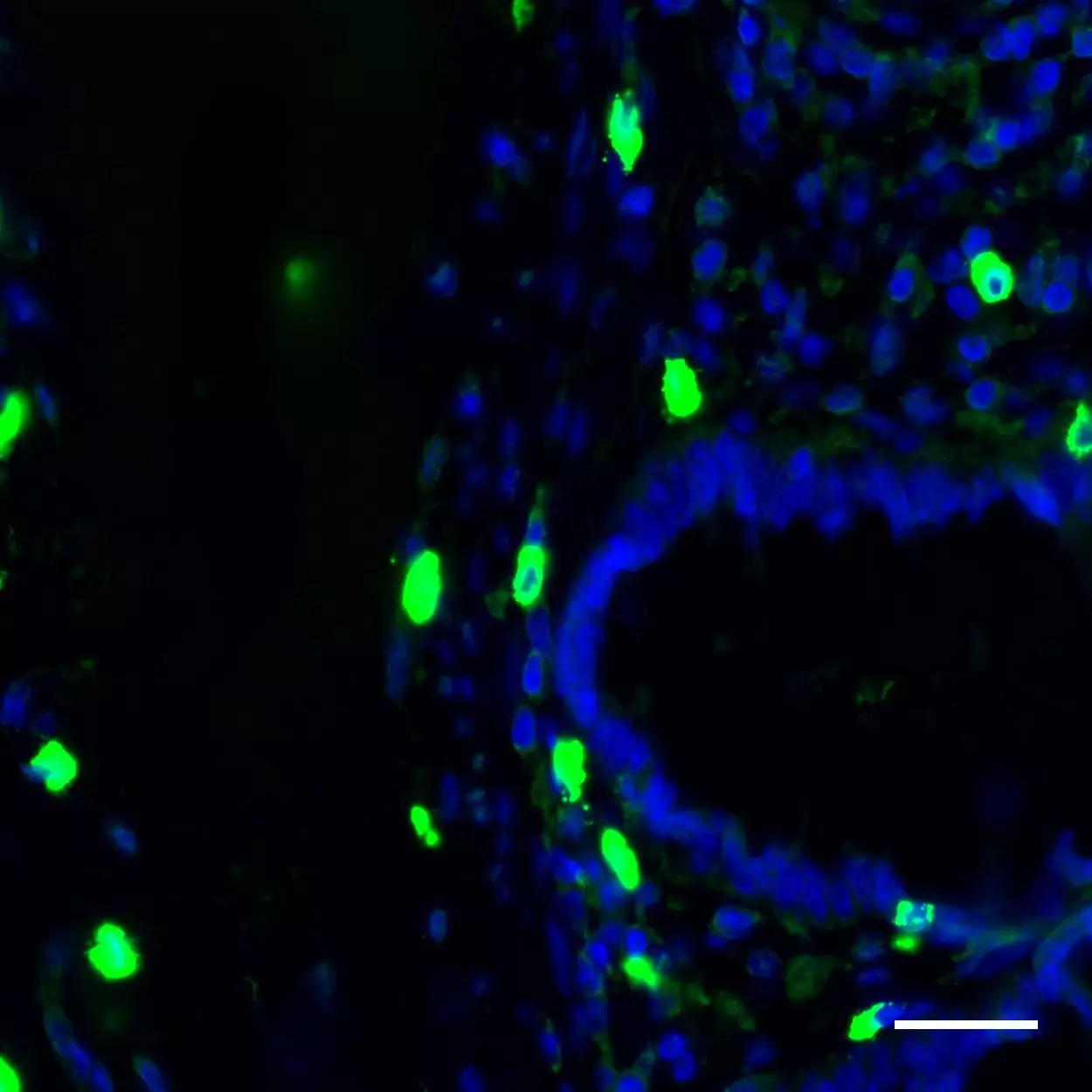 CD183 (CXCR3) Antibody, anti-human, REAdye_lease™ | Miltenyi Biotec | USA