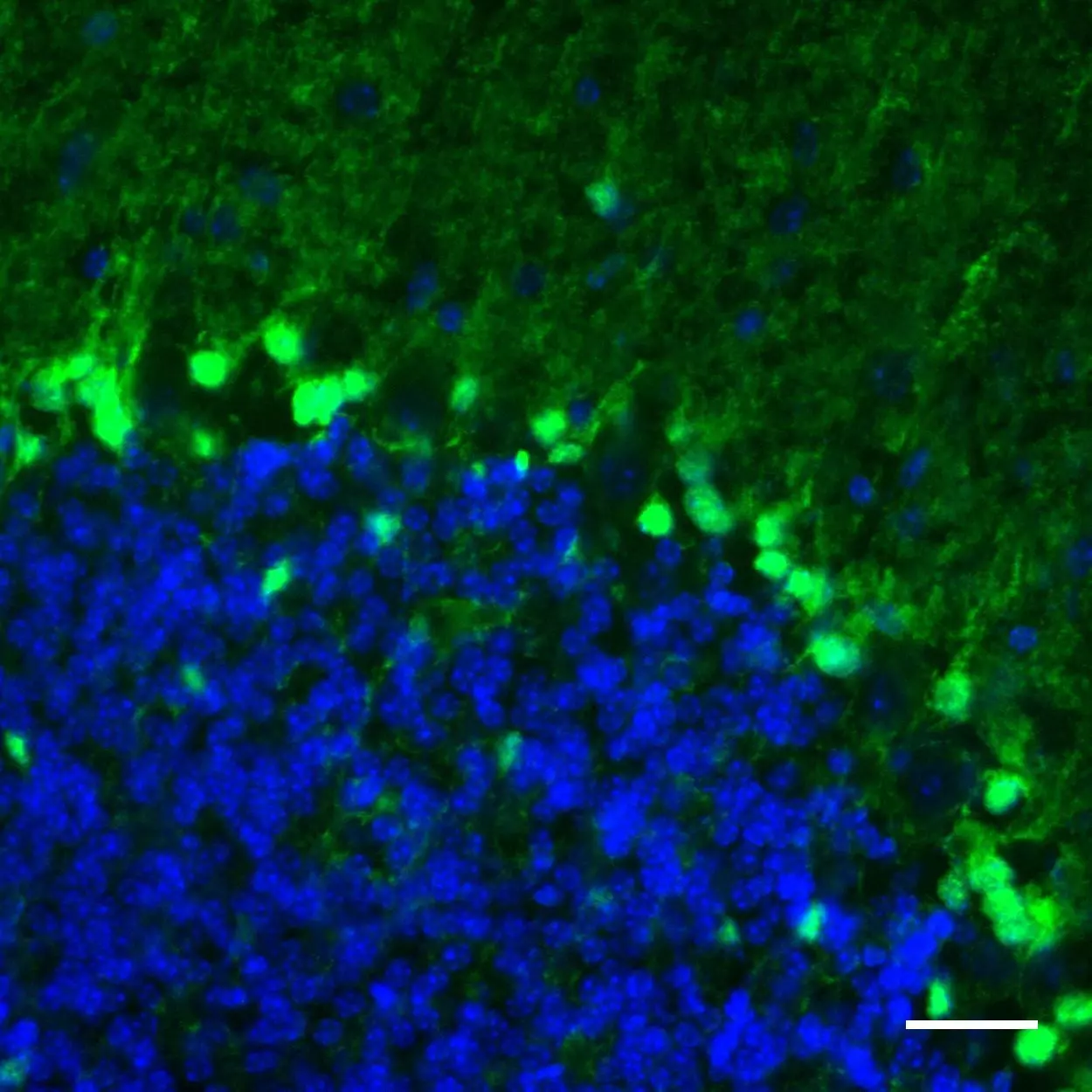 S100B Antibody, anti-human/mouse, REAdye_lease™ | Miltenyi Biotec | USA