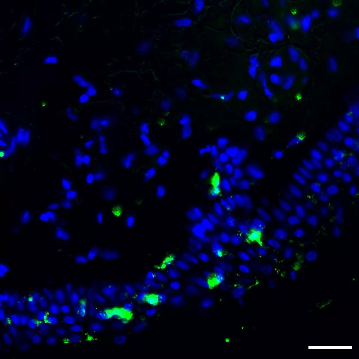 CD207 (Langerin) Antibody, anti-human, REAdye_lease™ | Miltenyi Biotec ...