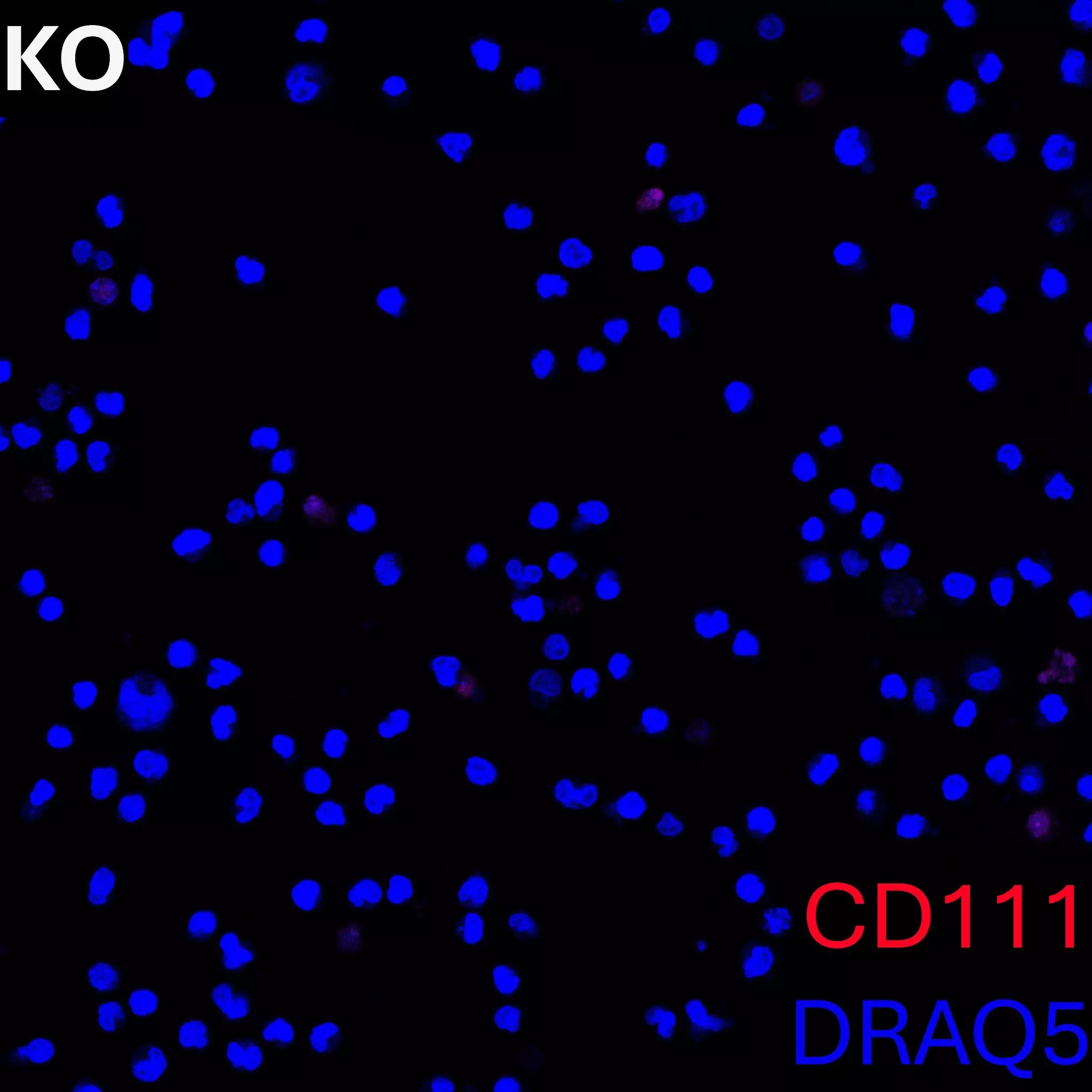 CD111 Antibody, anti-human, REAfinity™ | Miltenyi Biotec | India