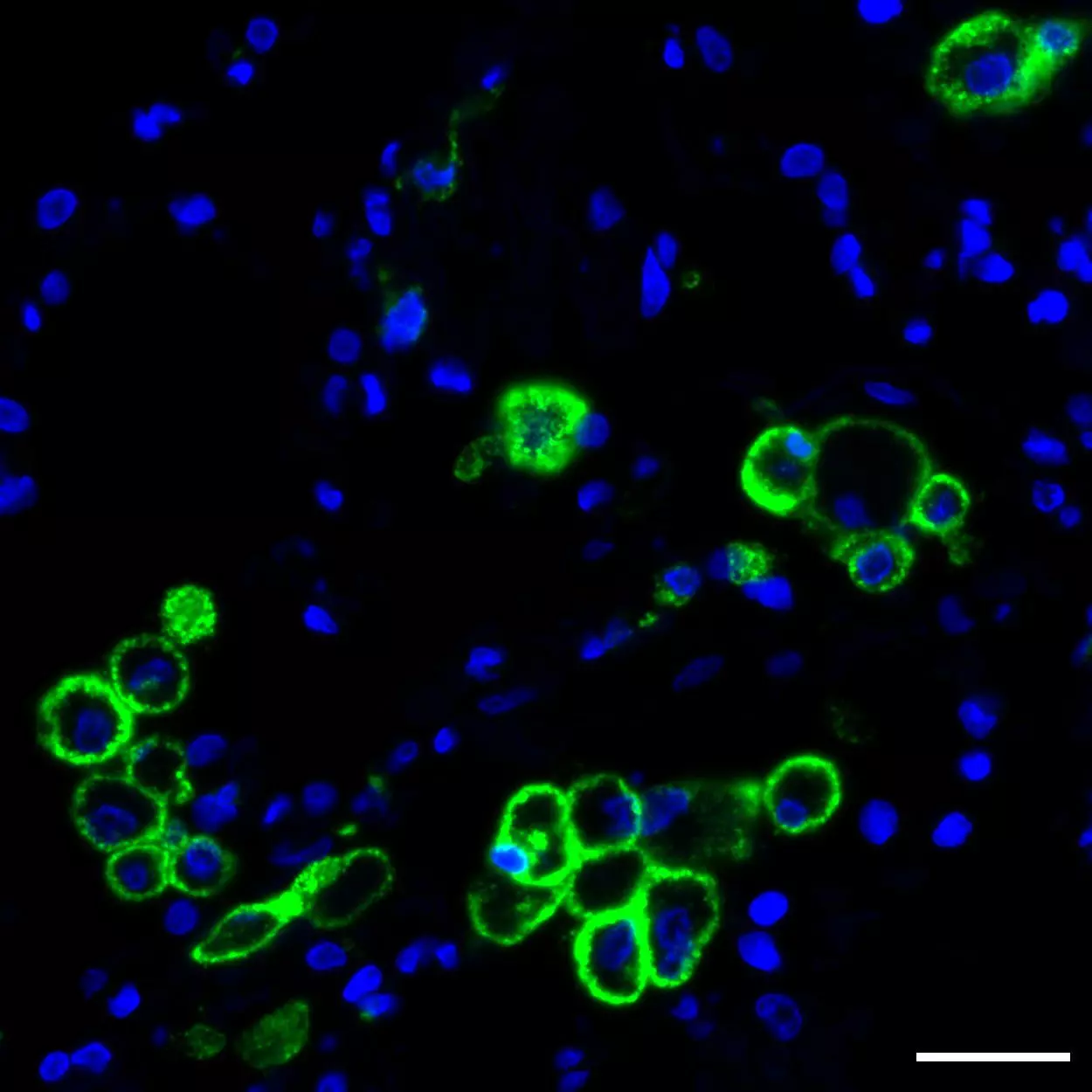 CD206 (MMR) Antibody, anti-human/mouse, REAfinity™ | Miltenyi Biotec | 中国