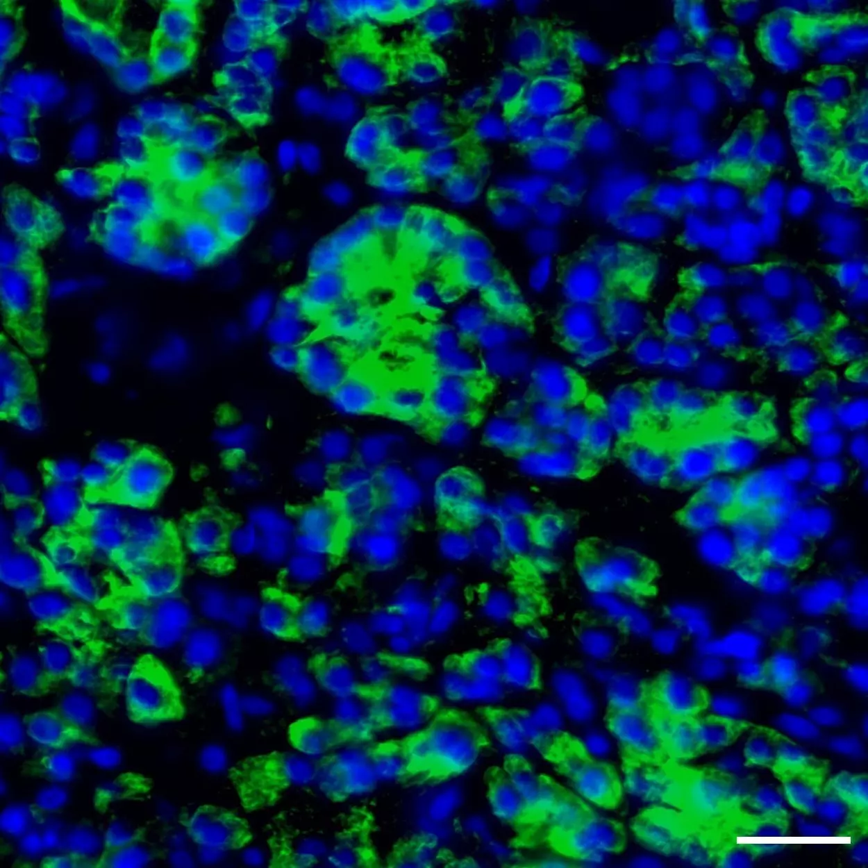Cytokeratin LMW Antibody, anti-human, REAdye_lease™ | Miltenyi Biotec ...