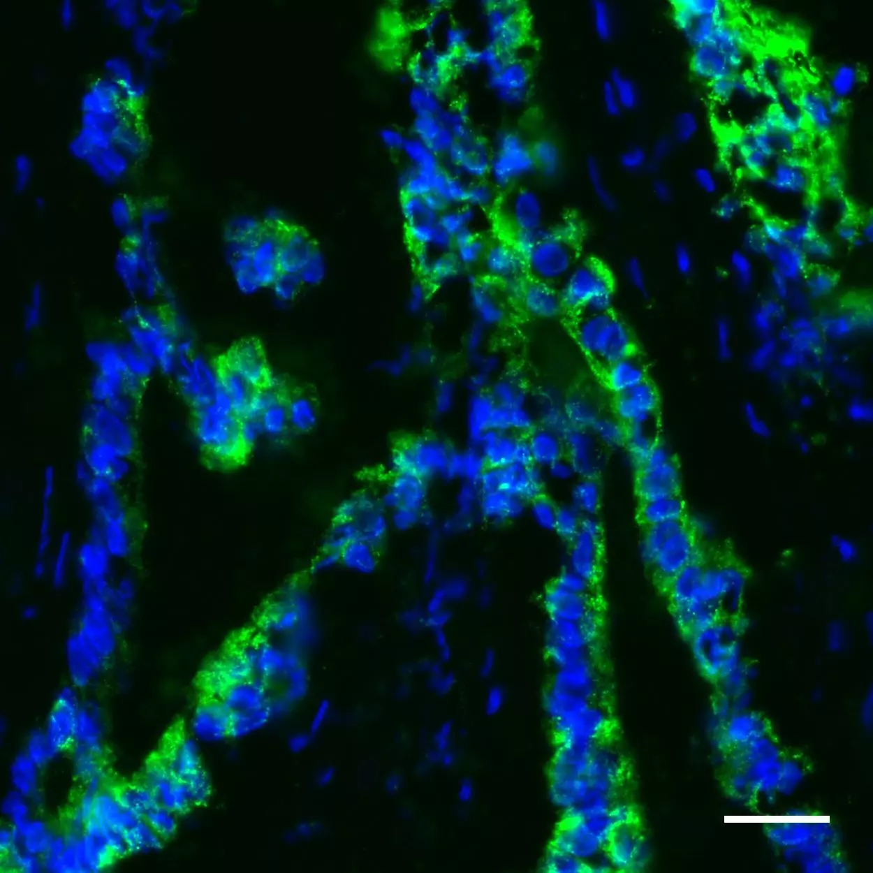 Mucin-5AC Antibody, anti-human, REAdye_lease™ | Miltenyi Biotec | USA