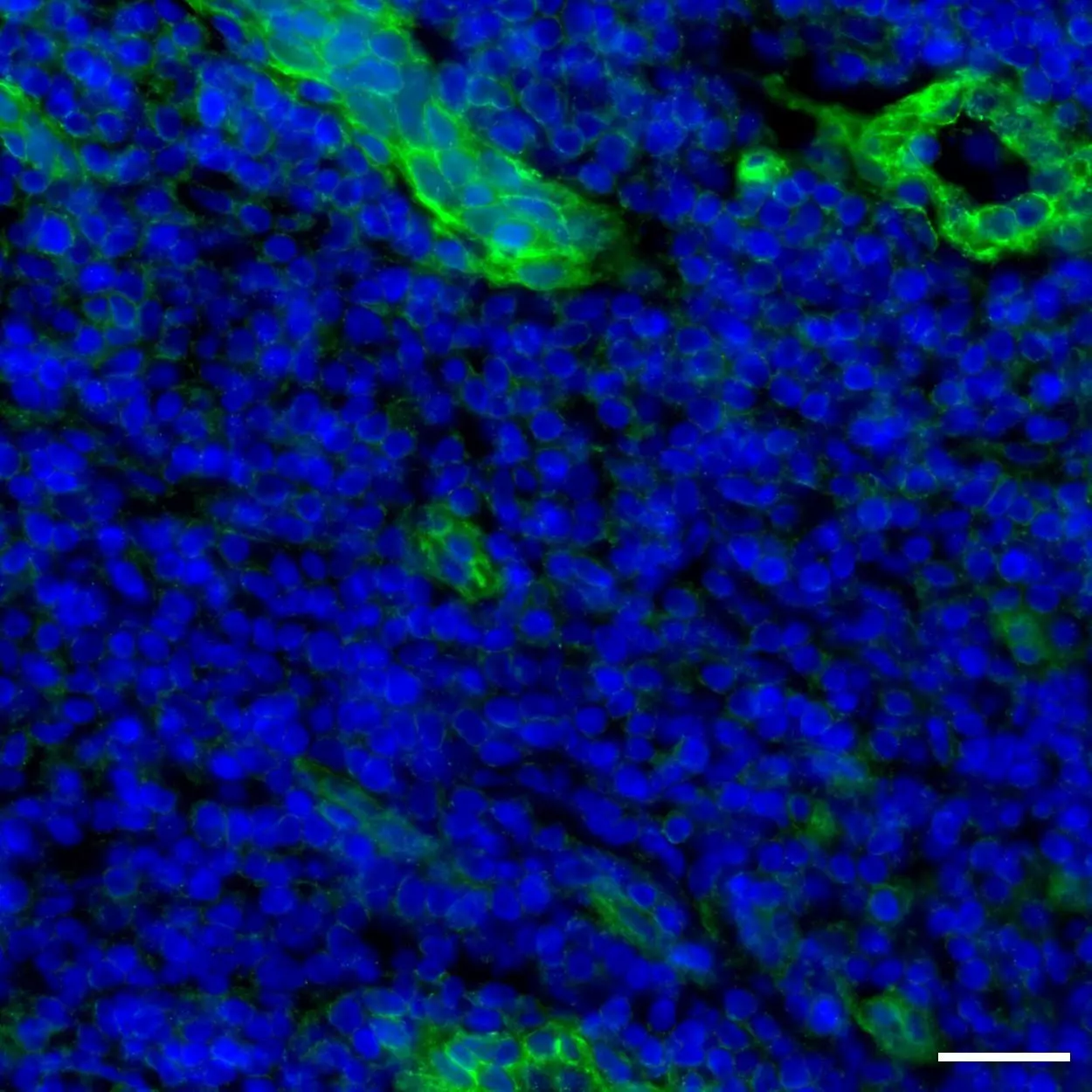 CD146 (MCAM) Antibody, anti-human, REAdye_lease™ | Miltenyi Biotec | USA