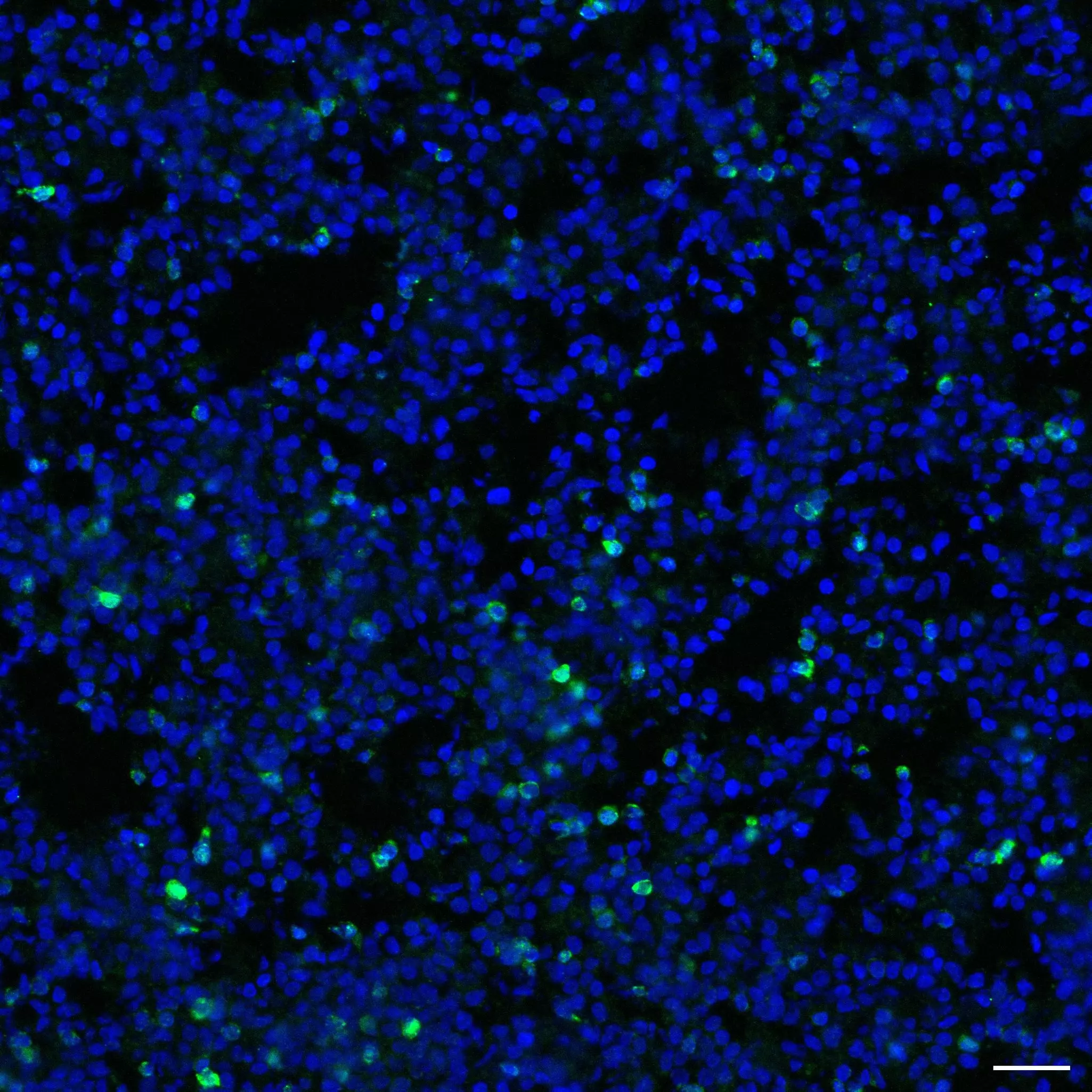 Granzyme B Antibody, anti-human, REAfinity™ | Miltenyi Biotec | Australia