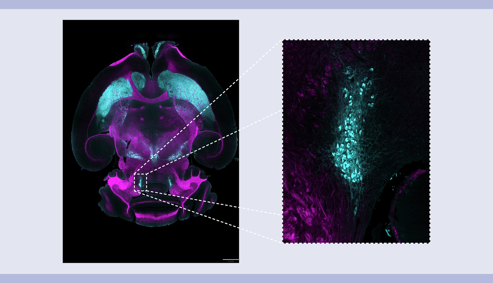 LightSpeed Mode for UltraMicroscope Blaze™ – Faster than ever, precise ...