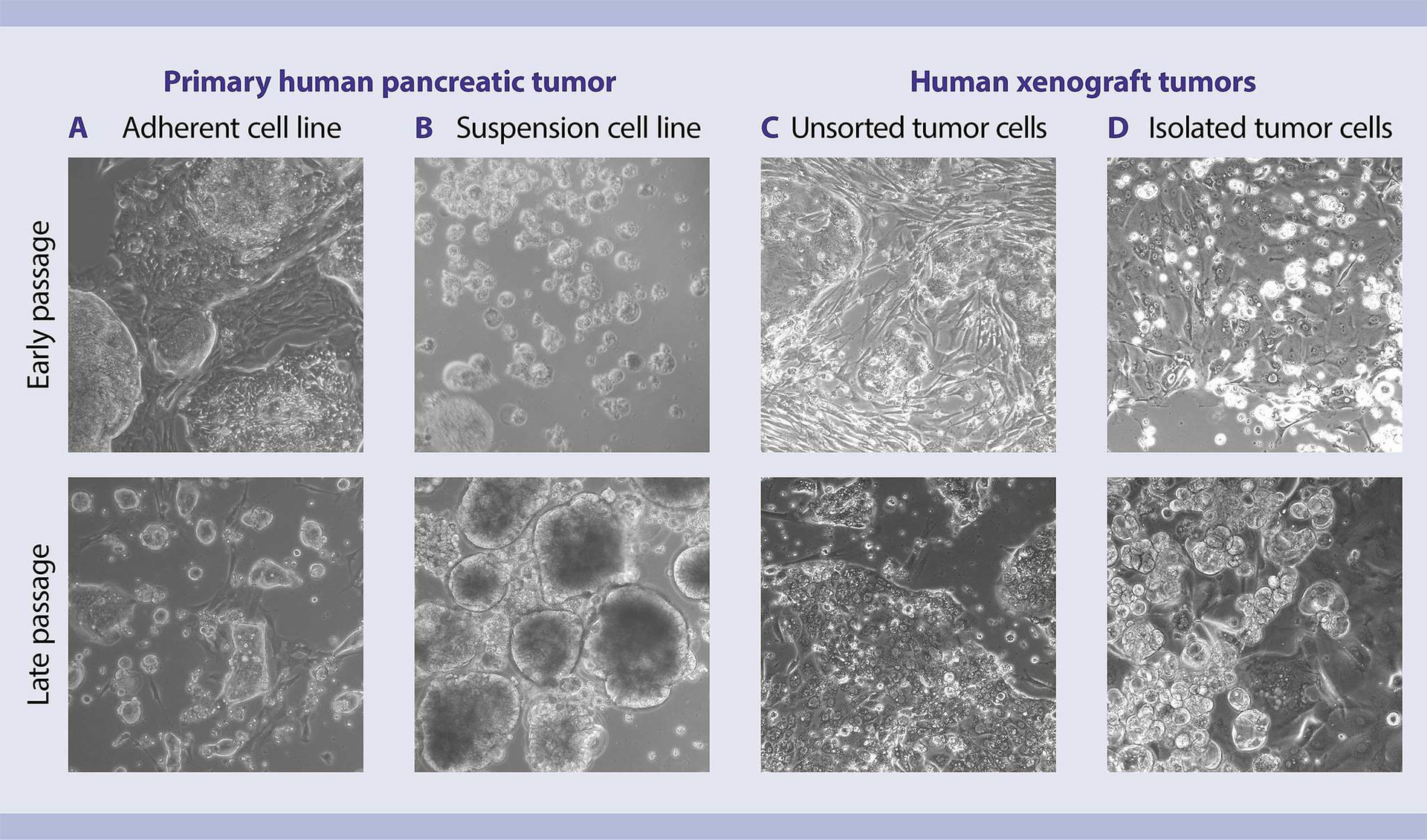 Cancer Cell Culture | Primary Tumor Cell Culture | Miltenyi Biotec ...