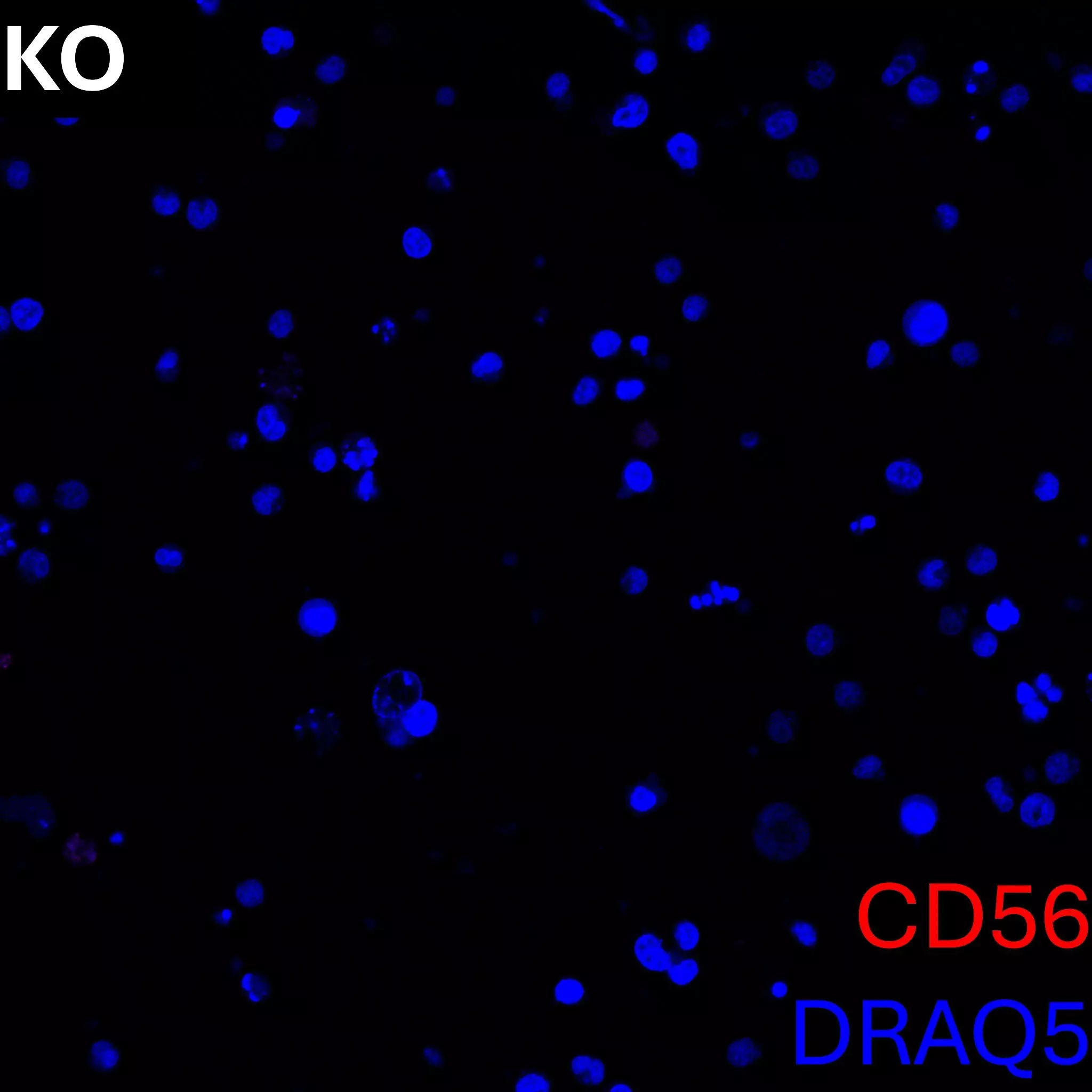 CD56 Antibody, anti-human, REAlease® | Miltenyi Biotec | USA