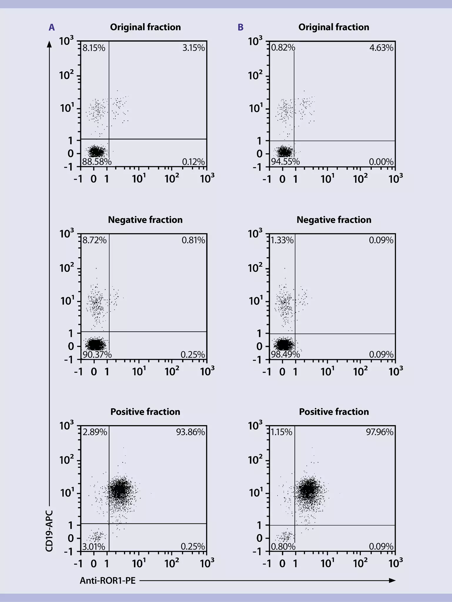 B cell malignancies | B cell isolation protocol | Miltenyi | Miltenyi ...