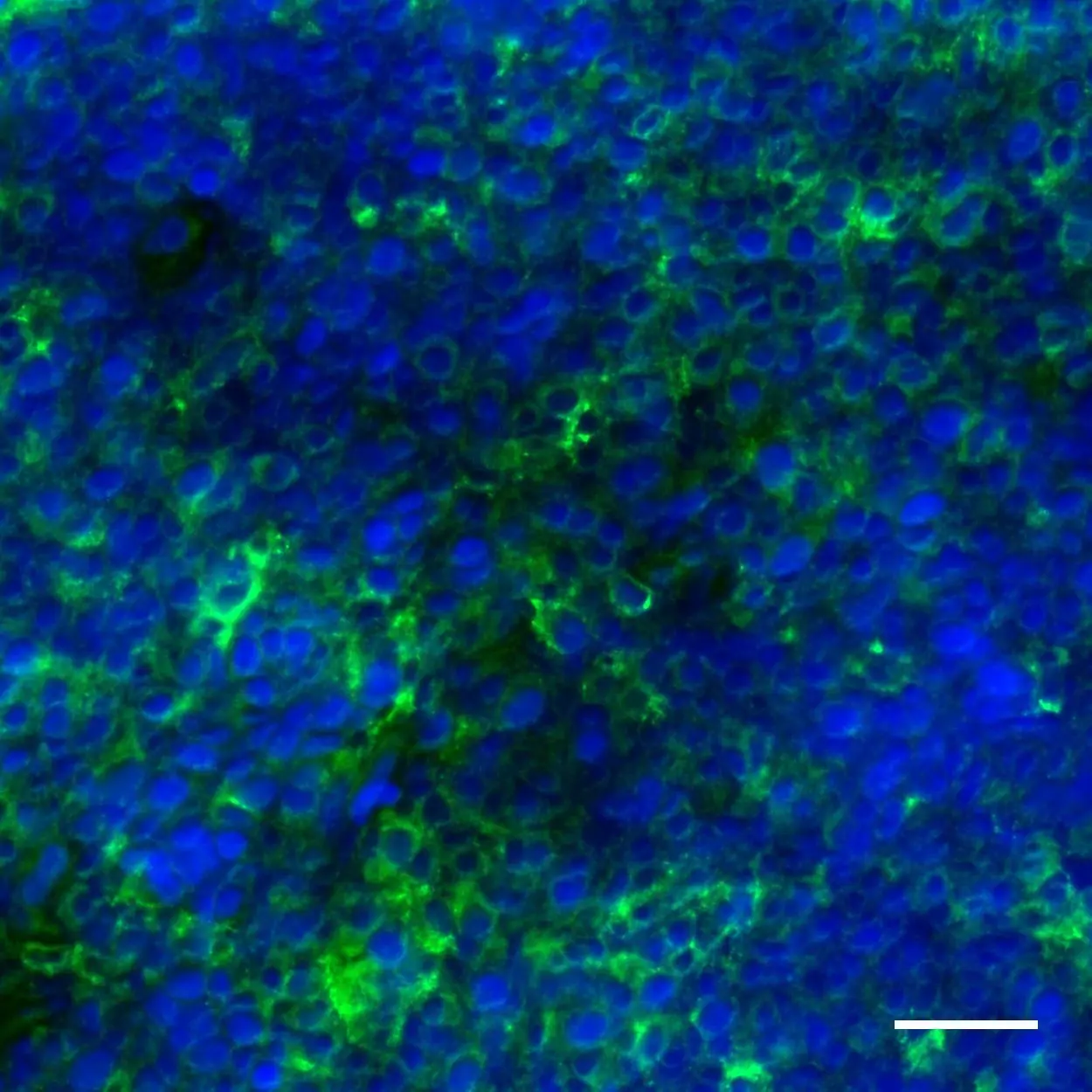 CD11c Antibody, anti-human, REAlease® | Miltenyi Biotec | India