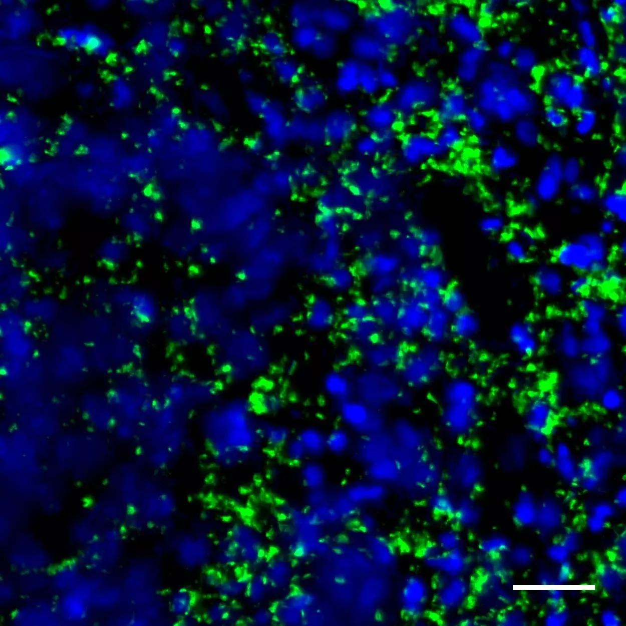 CD41/CD61 Antibody, anti-human, REAlease® | Miltenyi Biotec | USA