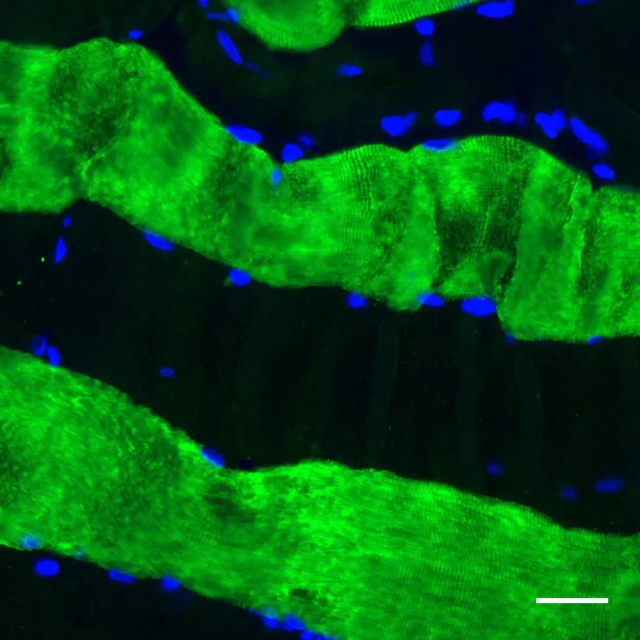 MYH7B Antibody, anti-human, REAdye_lease™ | Miltenyi Biotec | USA