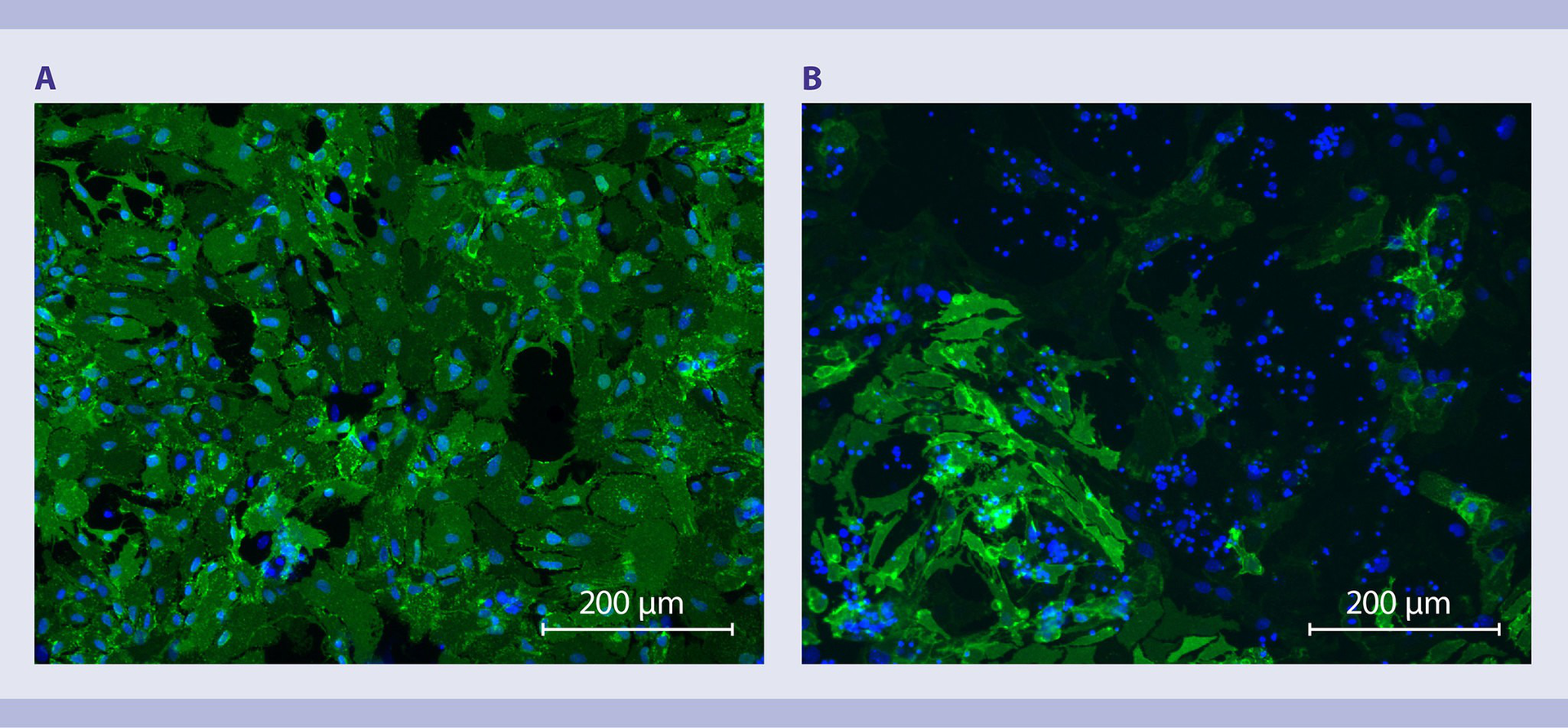 Astrocytes | Astrocyte Culture Isolation Characterization ...