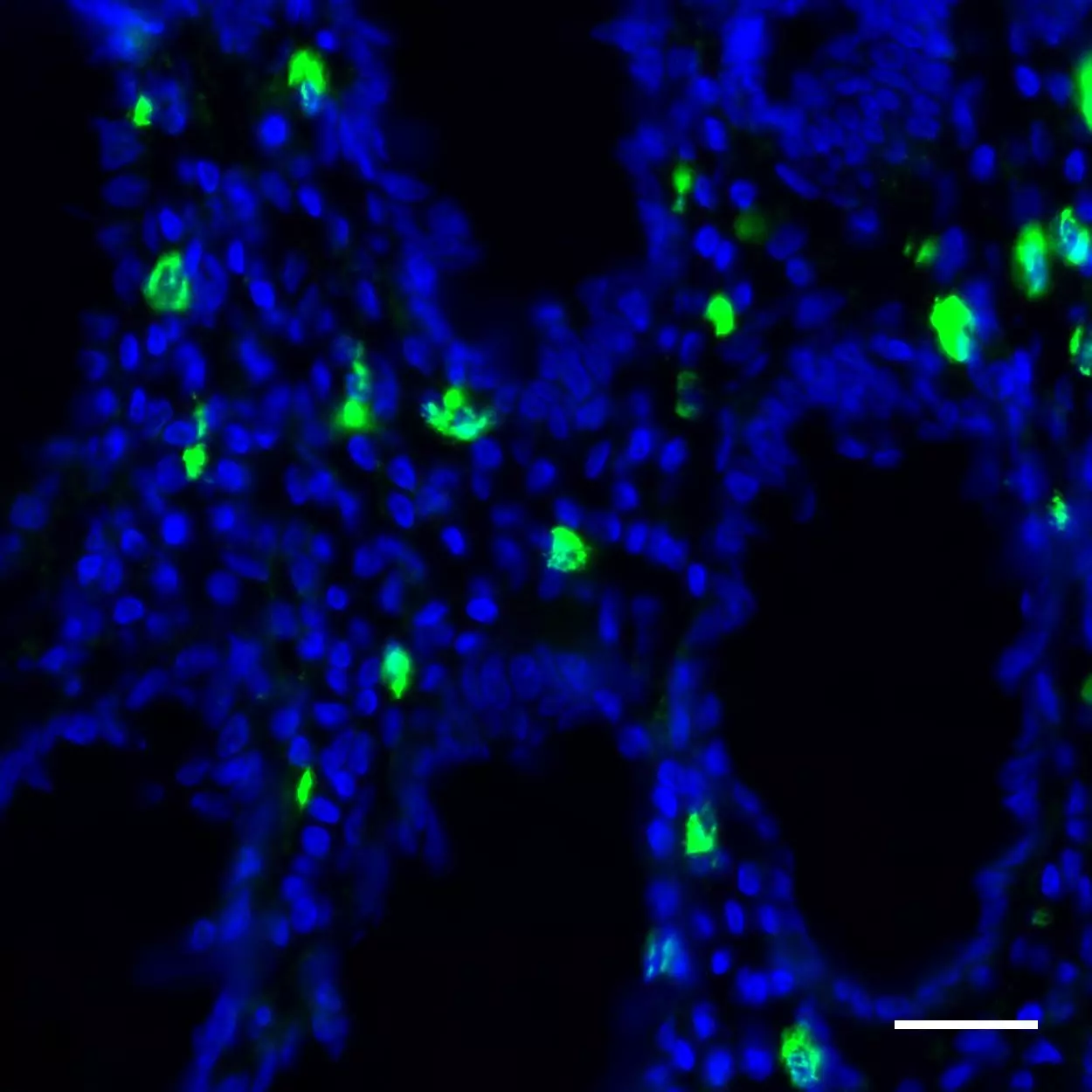 CD183 (CXCR3) Antibody, anti-human, REAdye_lease™ | Miltenyi Biotec | USA