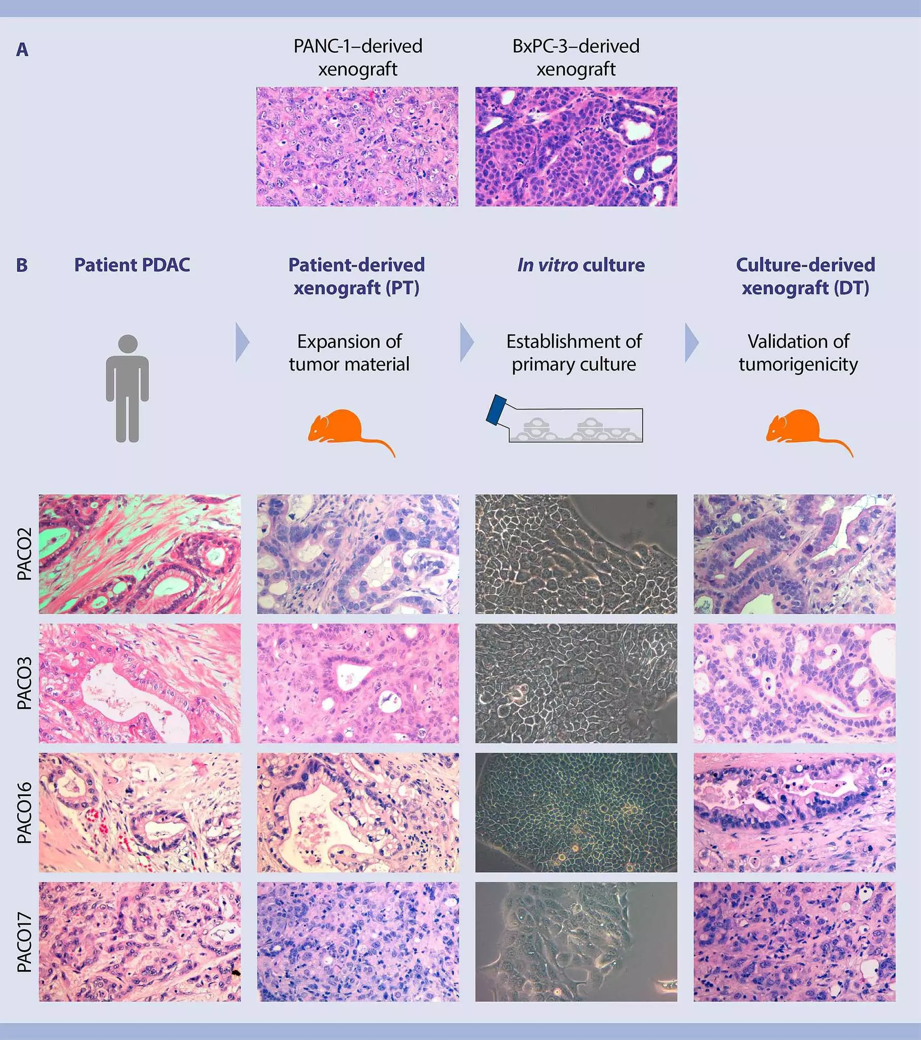 Initiation of human tumor cell culture from primary tumors | Miltenyi ...