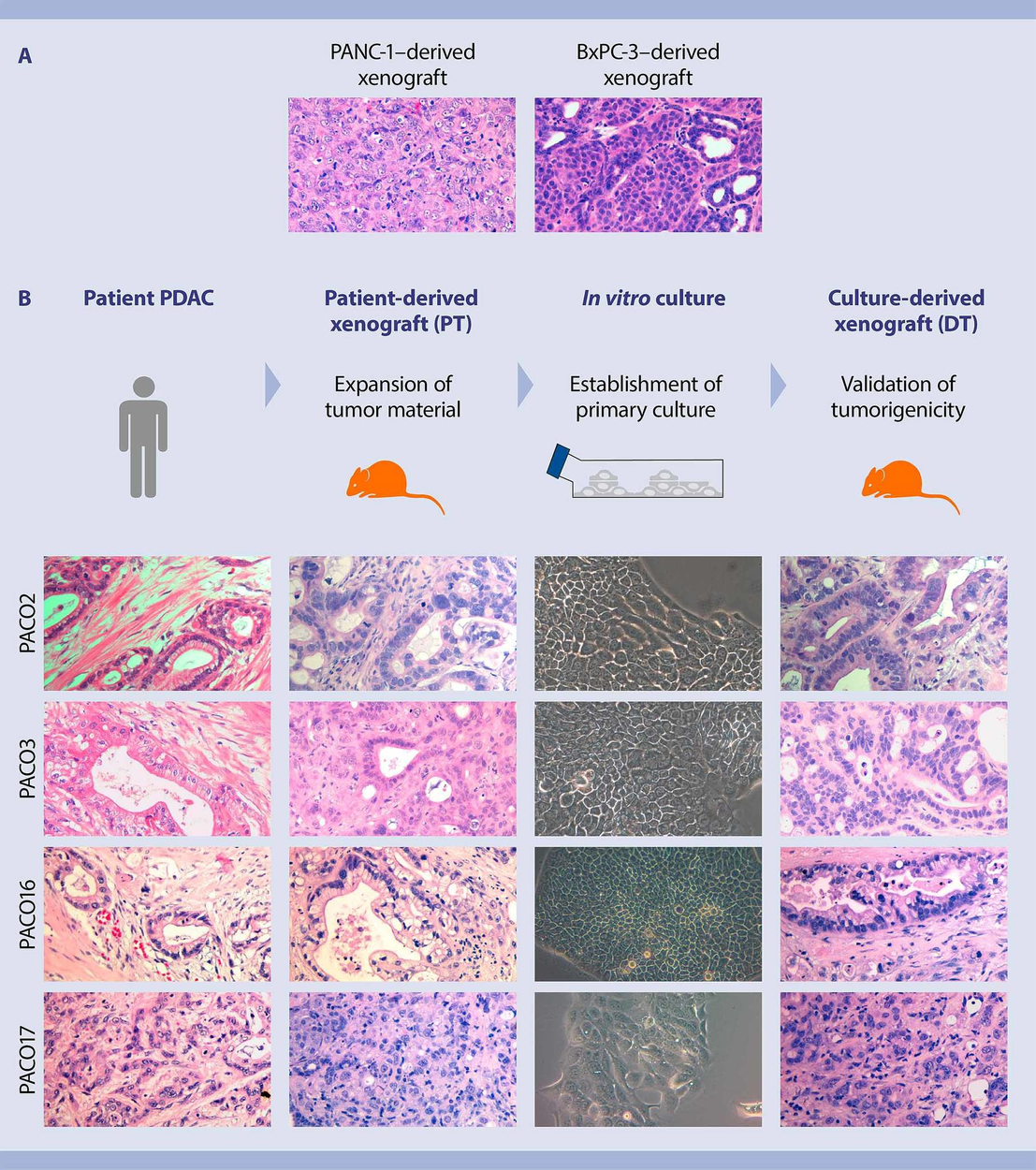 Initiation of human tumor cell culture from primary tumors | Miltenyi ...