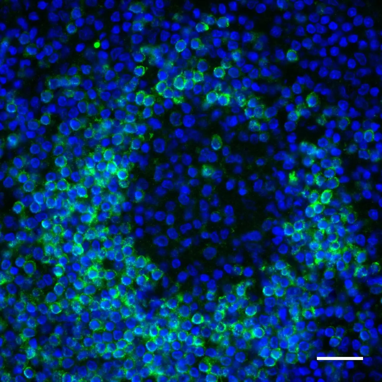 CD79a Antibody, anti-human, REAdye_lease™ | Miltenyi Biotec | USA