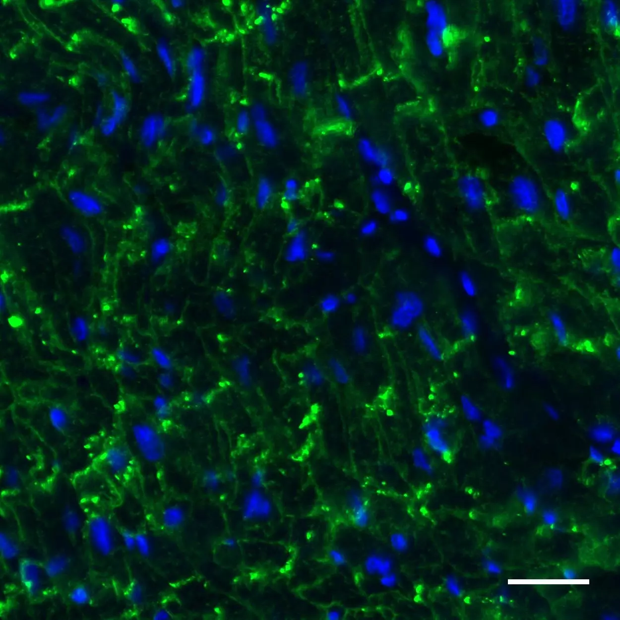 Connexin 43 (GJA1) Antibody, anti-human, REAdye_lease™ | Miltenyi ...