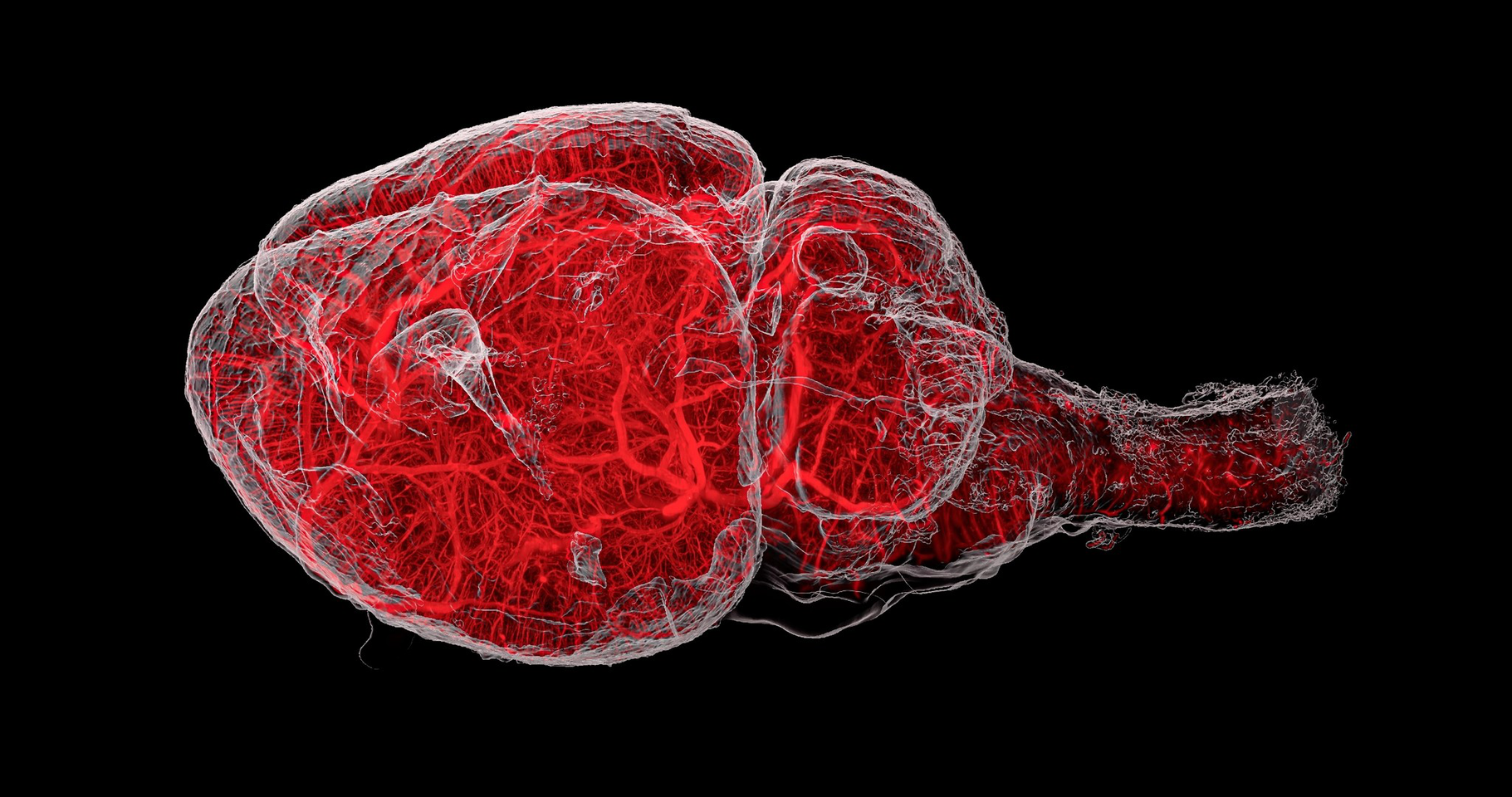 Immunostaining And Clearing Mouse Brain Imaging Miltenyi Biotec Lëtzebuerg