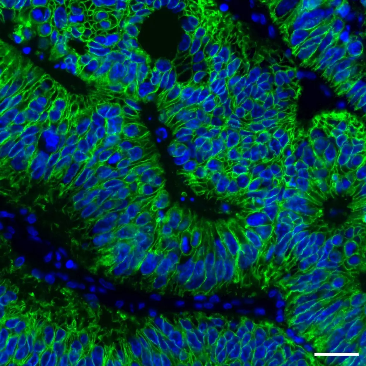 Cadherin-17 Antibody, anti-human, REAdye_lease™ | Miltenyi Biotec | USA