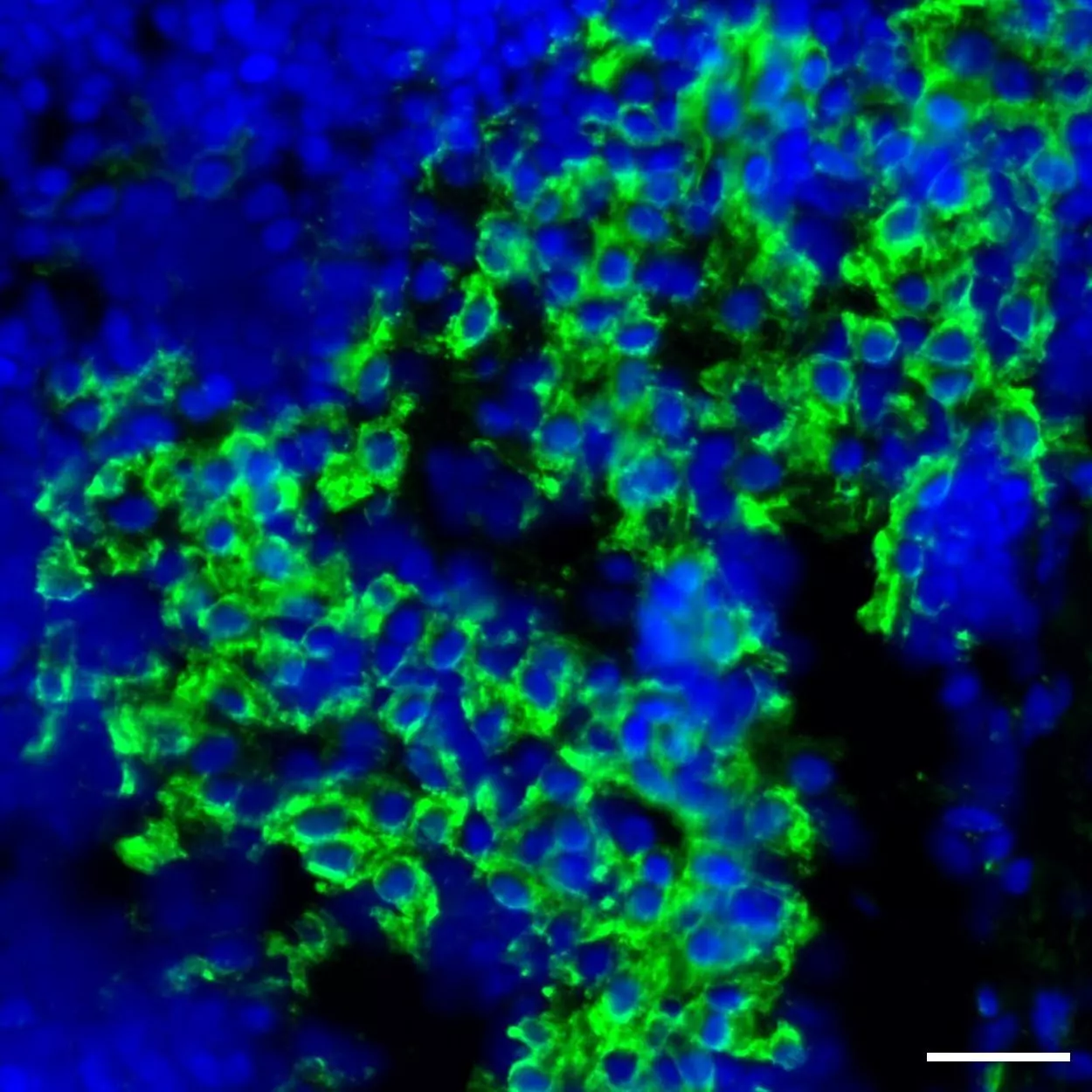 CD209 (DC-SIGN) Antibody, anti-human, REAdye_lease™ | Miltenyi Biotec | India