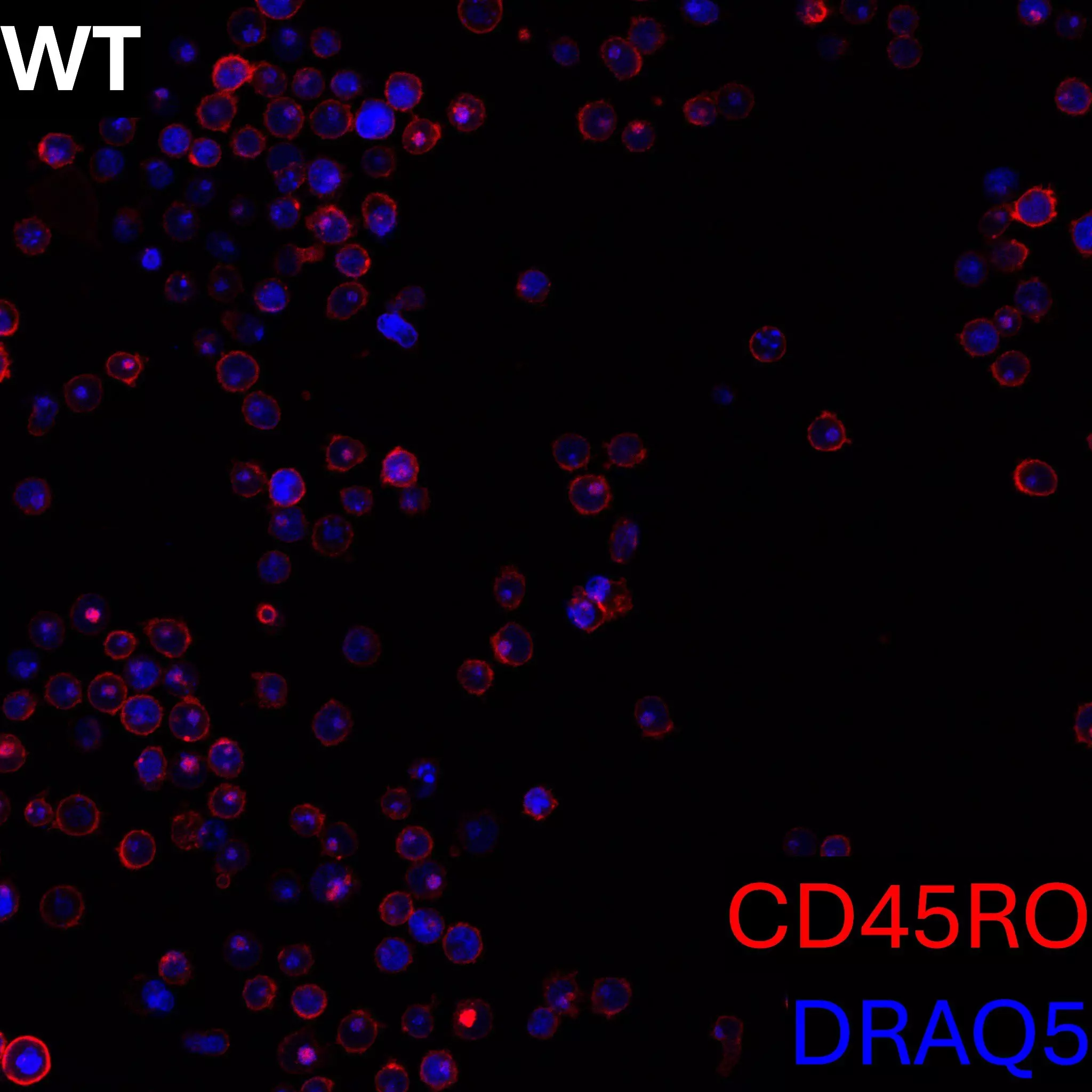CD45RO Antibody, anti-human, REAlease® | Miltenyi Biotec | 日本