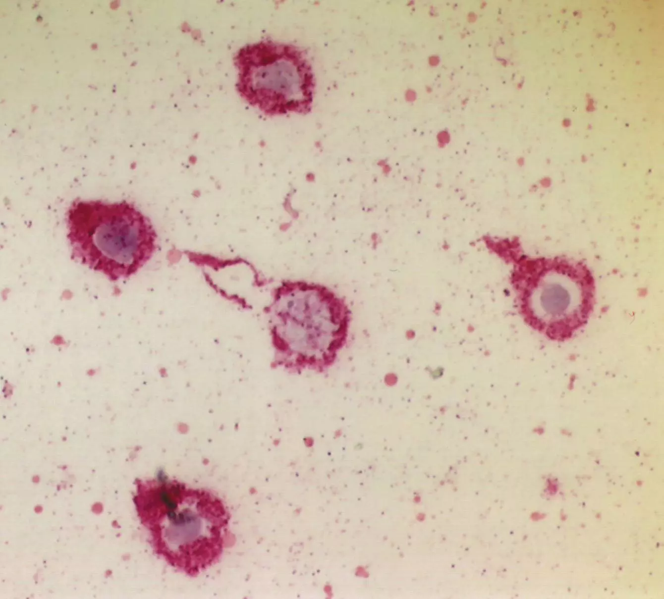 Haemophilus Ducreyi School Of Fish