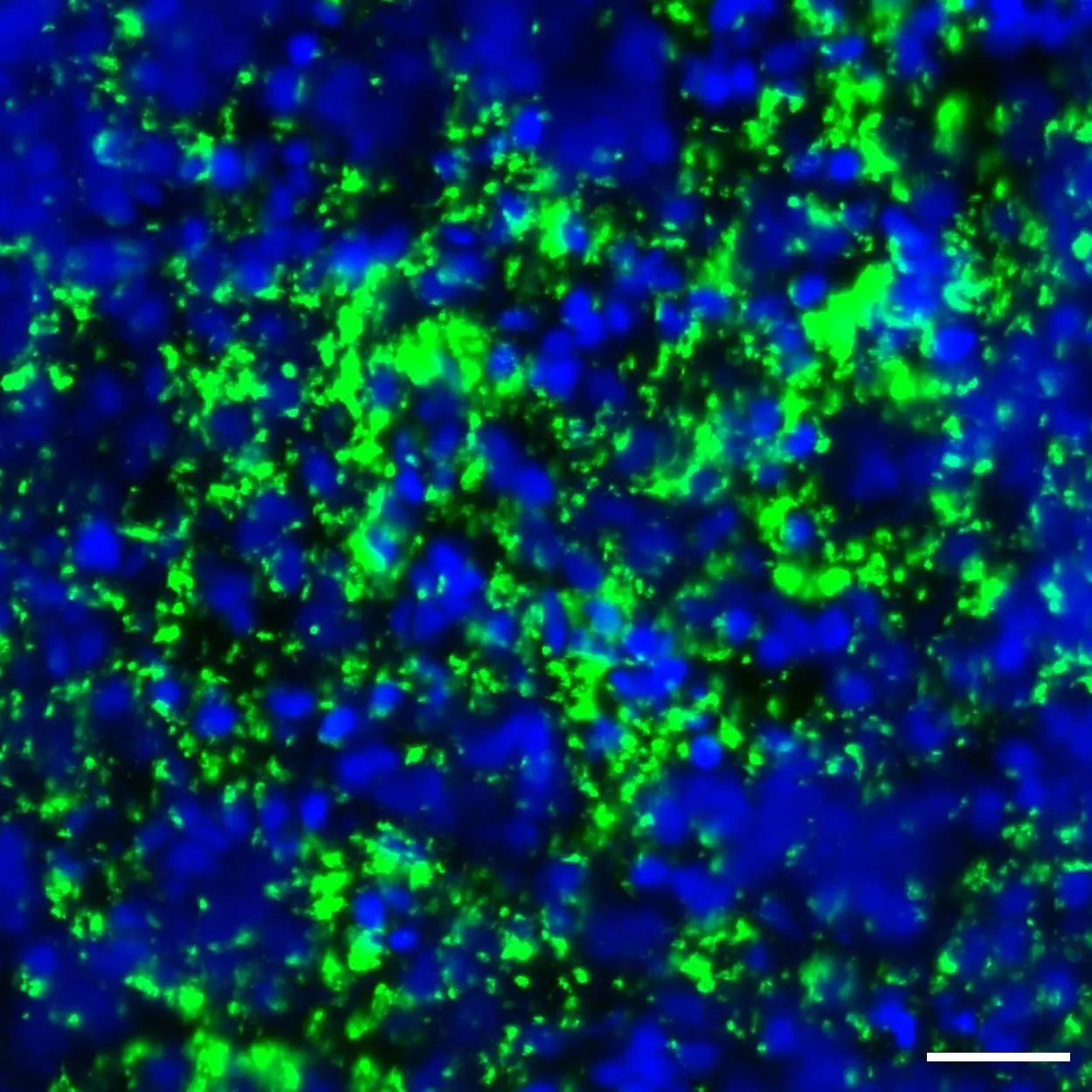 CD41/CD61 Antibody, anti-human, REAlease® | Miltenyi Biotec | USA