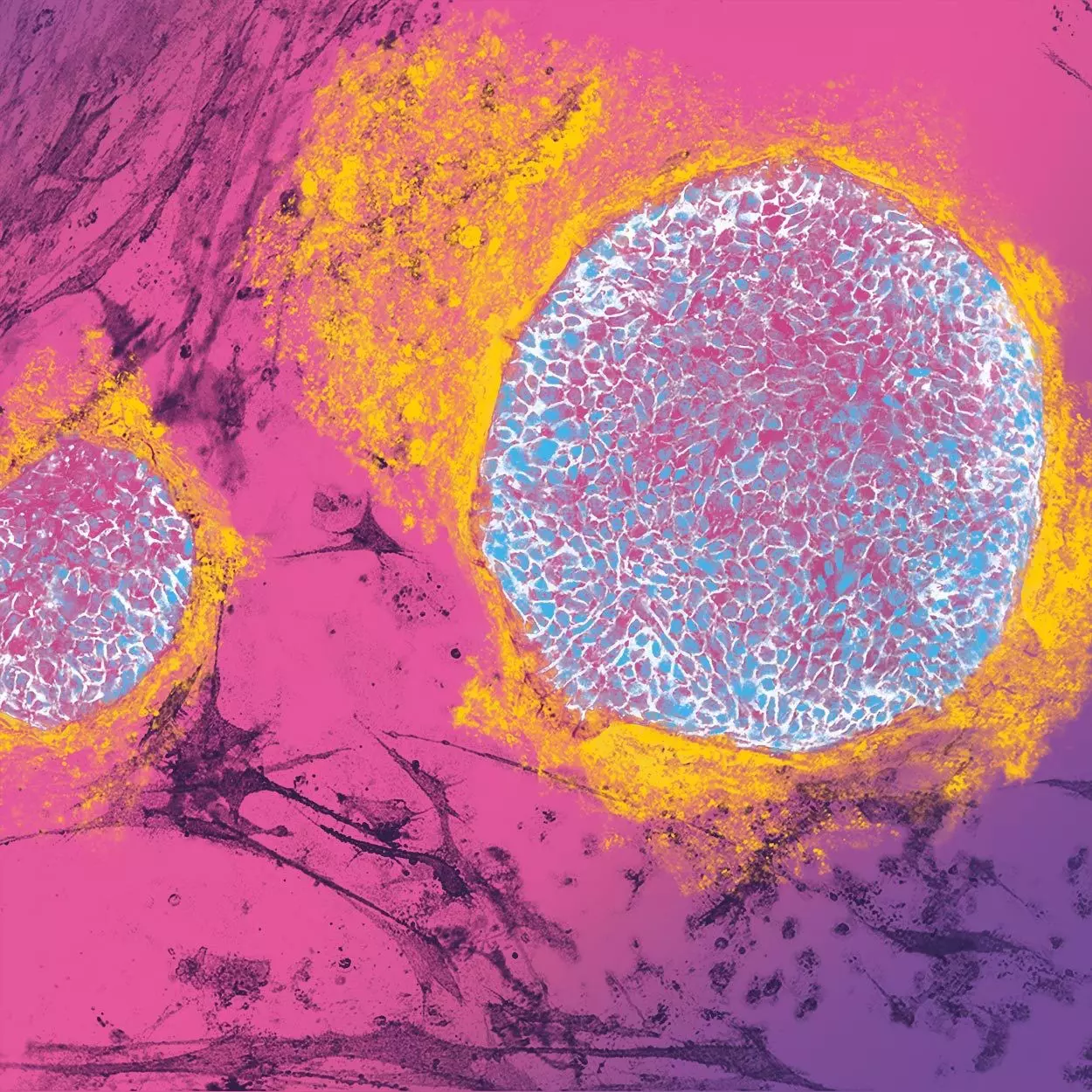 Pluripotent Stem Cell Differentiation | Workflow | Miltenyi Biotec | भारत