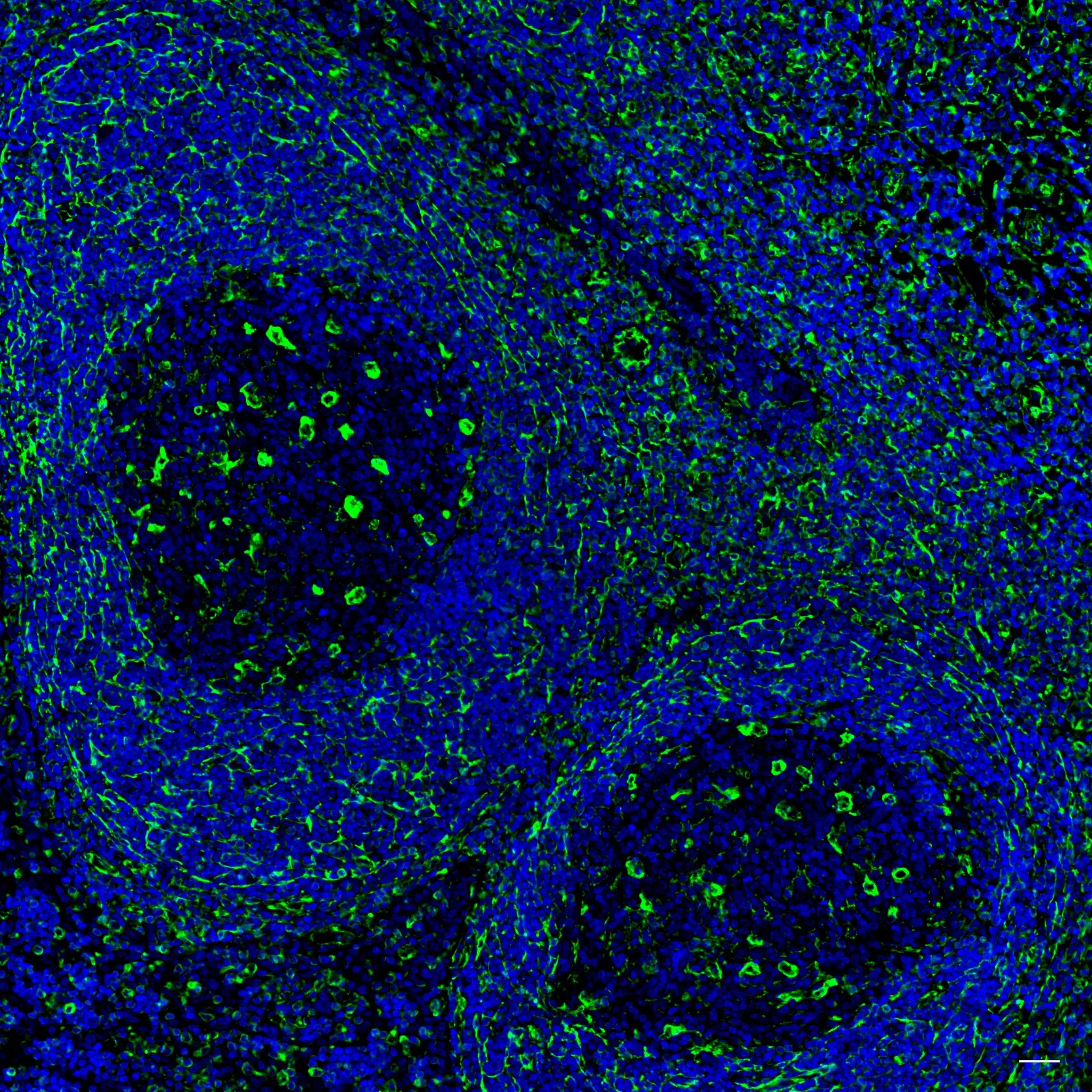 Vimentin Antibody, anti-human, REAfinity™ | Miltenyi Biotec | USA