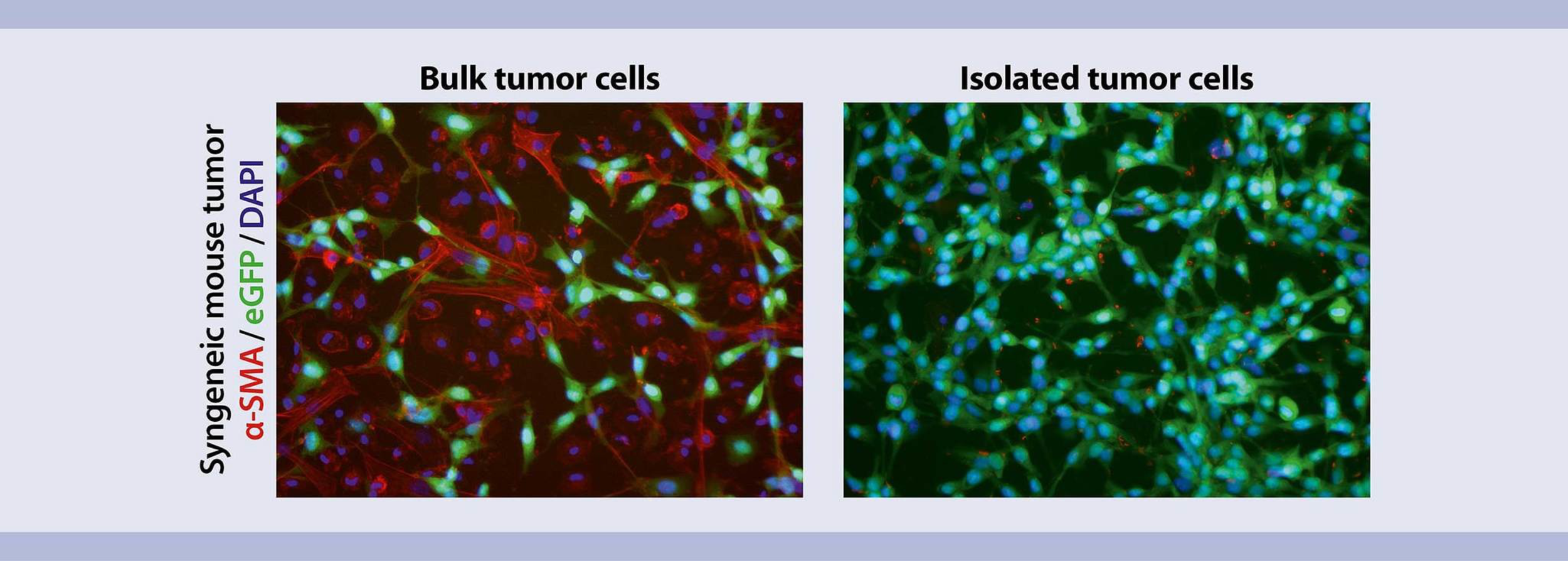 Isolation of tumor cells from mouse tumor tissue samples | Miltenyi ...