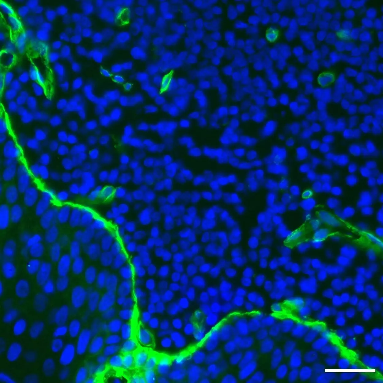 CD104 (Integrin β4) Antibody, anti-human, REAlease® | Miltenyi Biotec | USA